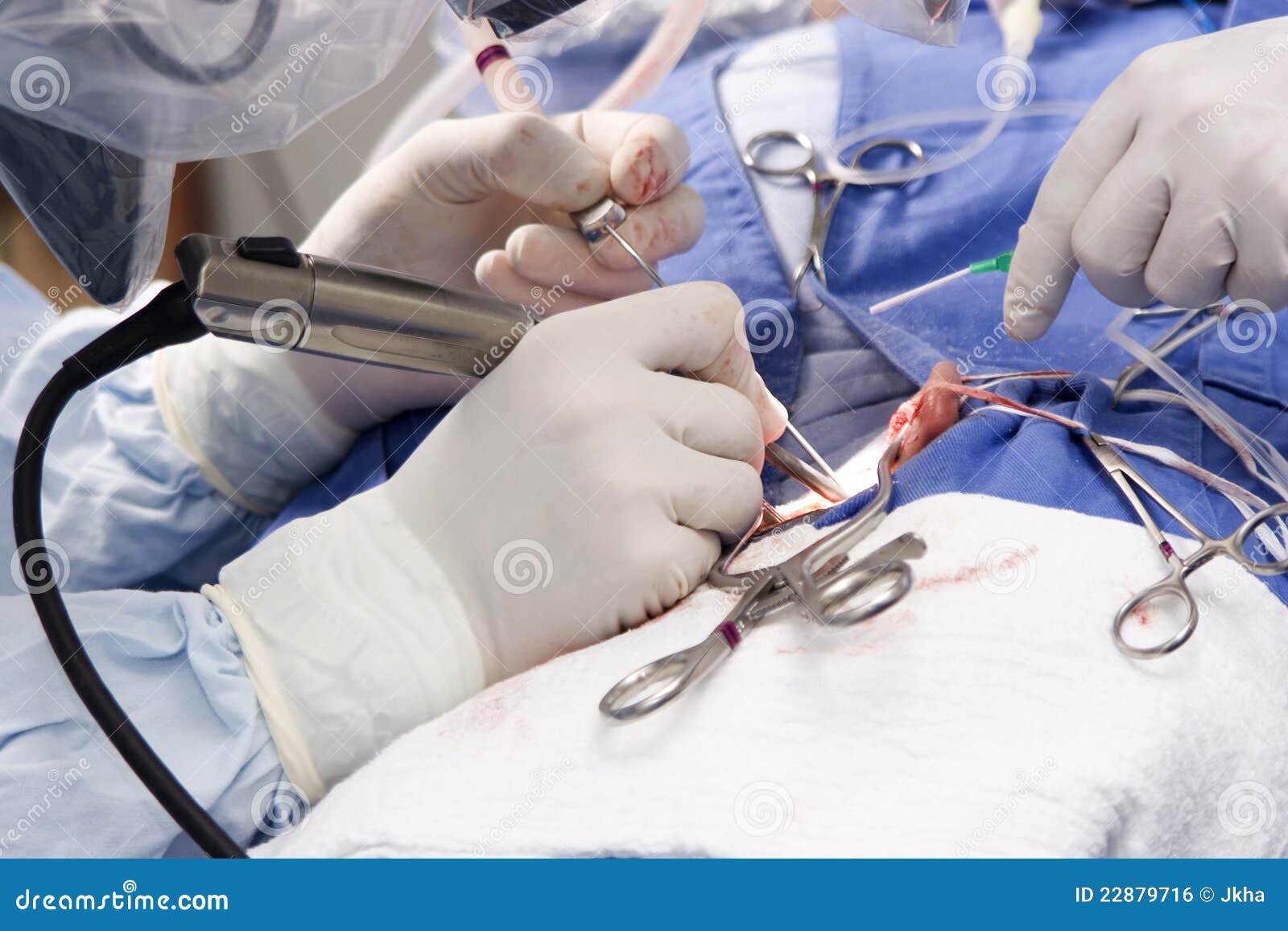 Surgeon Performing Surgery stock photo. Image of hand - 22879716