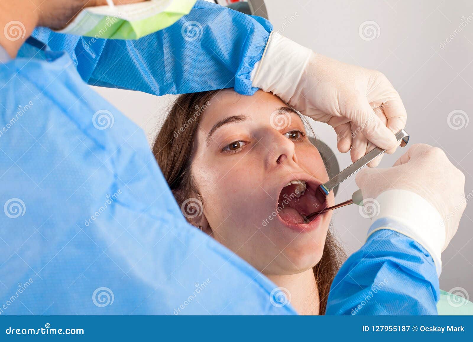 Dental extraction stock image. Image of extraction, calculus - 127955187