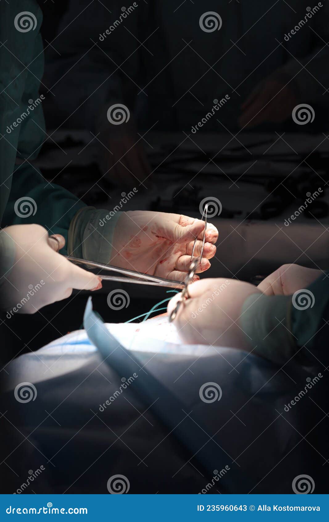 Surgeon Sutures after Laparoscopic Surgery. Completion of the Operation ...