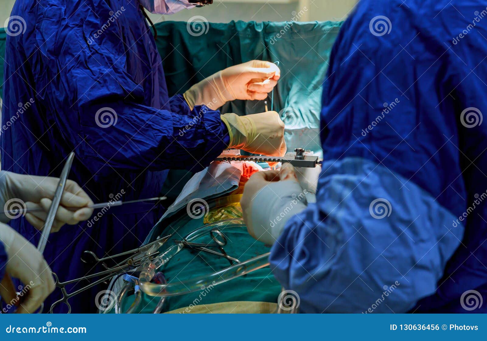 Surgeon with Surgical Instrument during the Open Heart Operation Stock ...