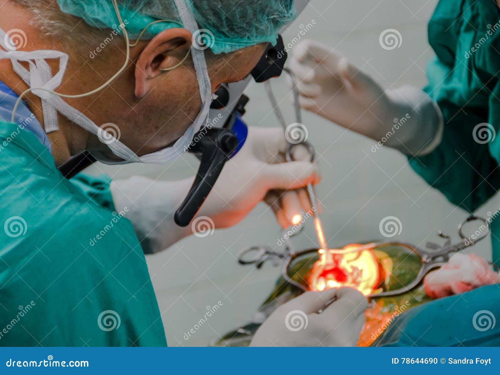 Surgeon Using a Microscope during Ear Surgery. Stock Photo - Image of ...