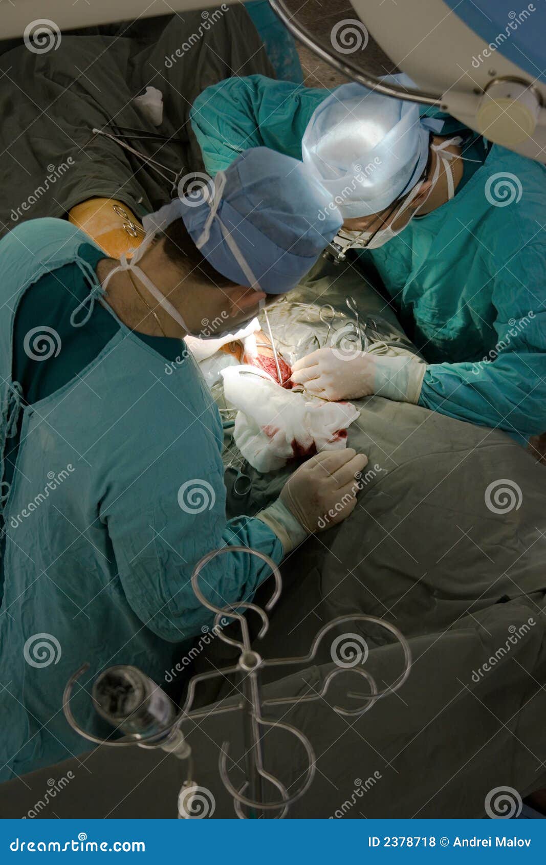 Surgeon. view from above stock photo. Image of patient - 2378718