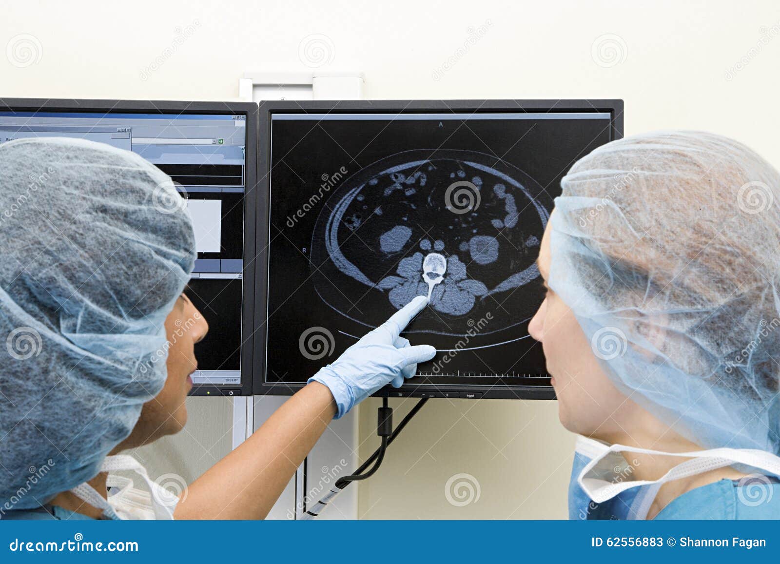 Surgeons looking at scan stock image. Image of asian - 62556883