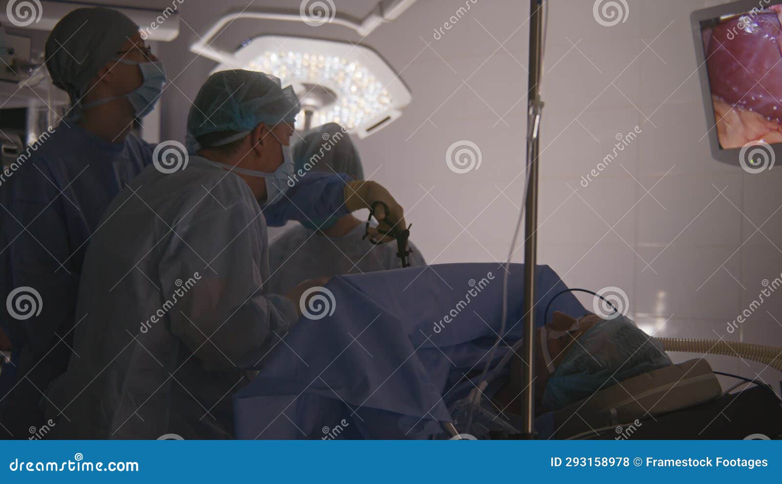 Surgeons Operate Patient Using Laparoscopy Tools Stock Footage - Video ...