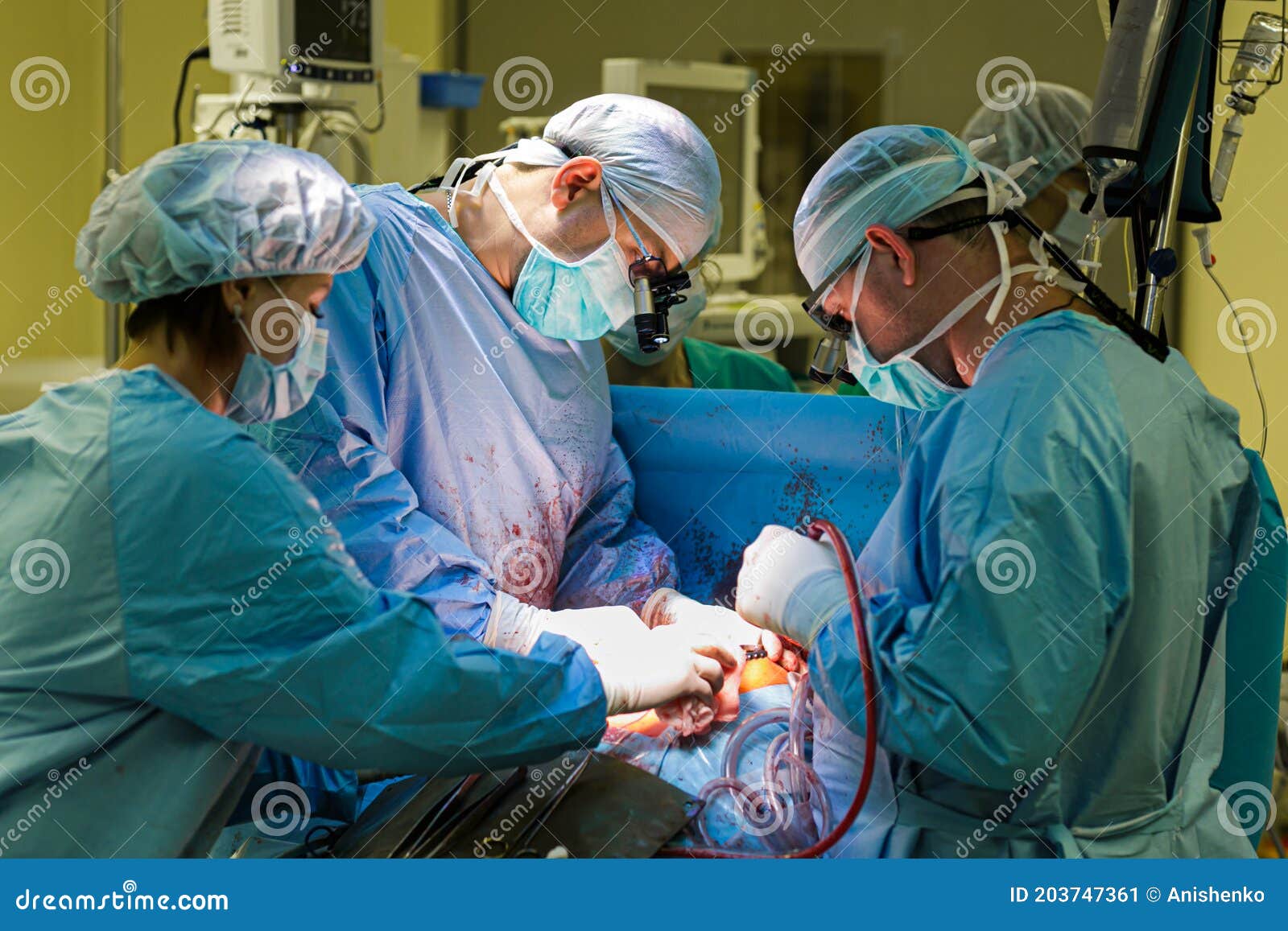 Surgeons in the Operating Room Do Operation Stock Image - Image of ...