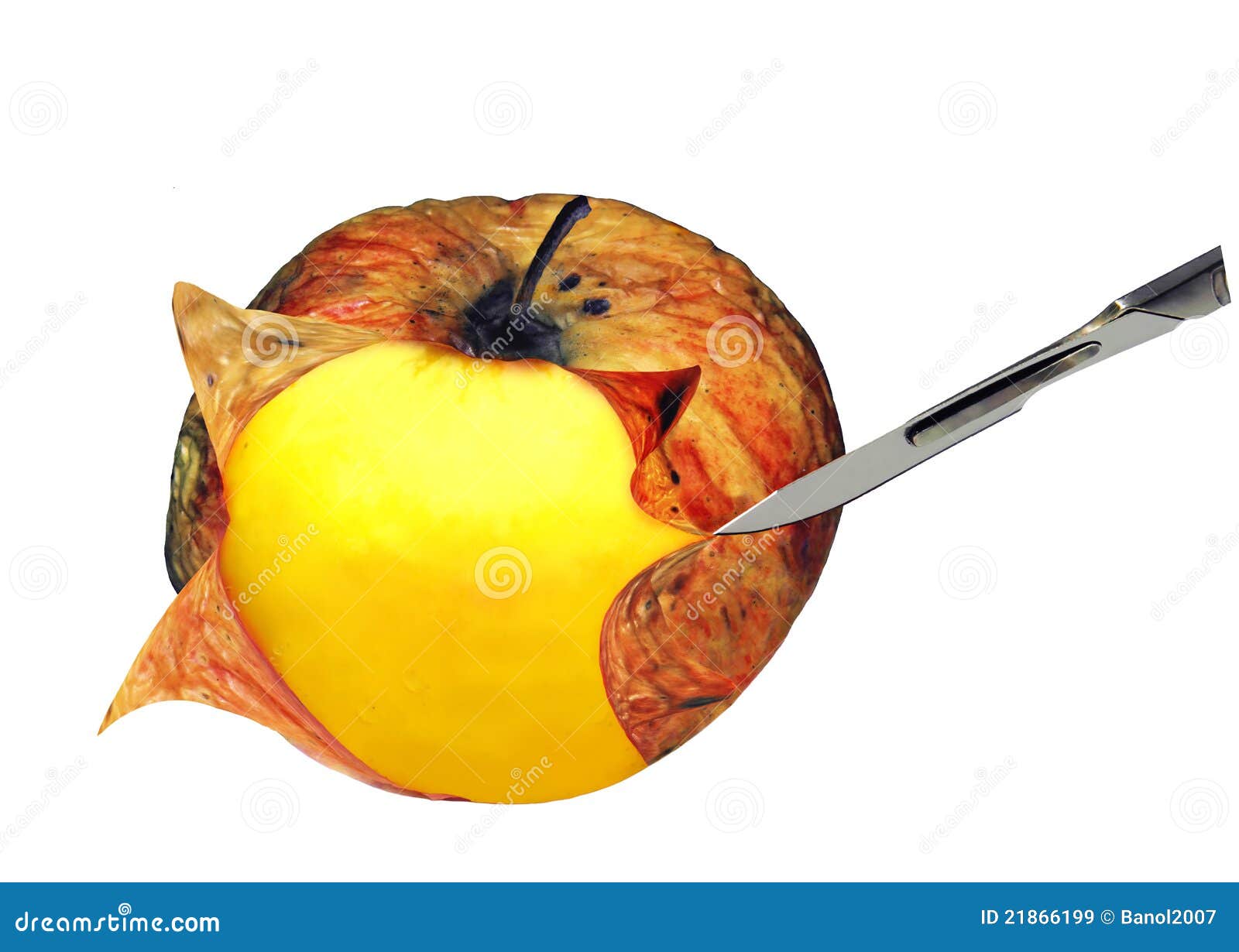 Skin, Scalpel & Apple. Concept. Isolated. Stock Image - Image of ...