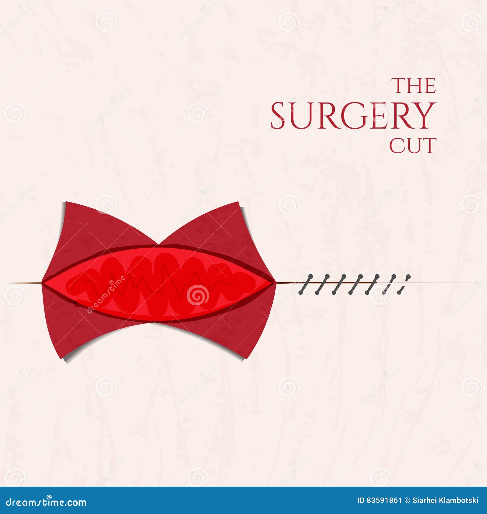 Surgery cut vector concept stock vector. Illustration of blood - 83591861
