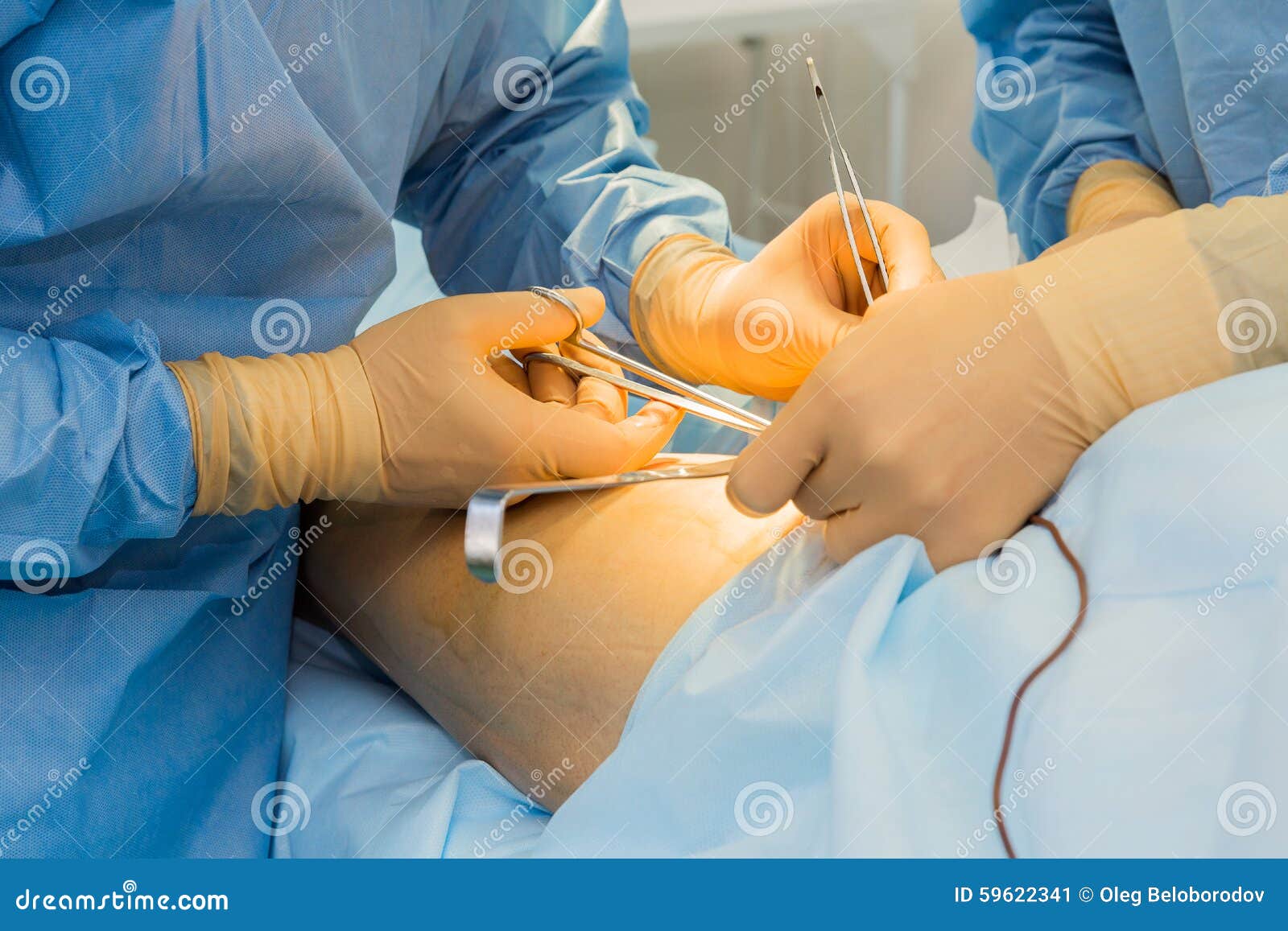 Surgery stock image. Image of surgeons, medicine, gloves - 59622341
