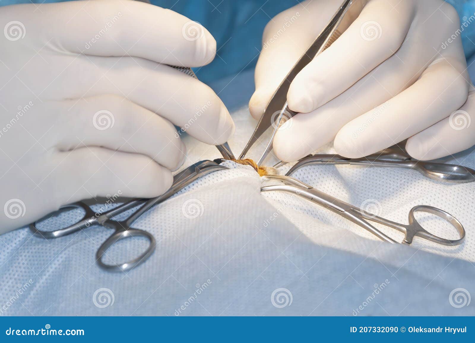 Surgery. Hands of a Surgeon in the Process of Work Stock Photo - Image ...