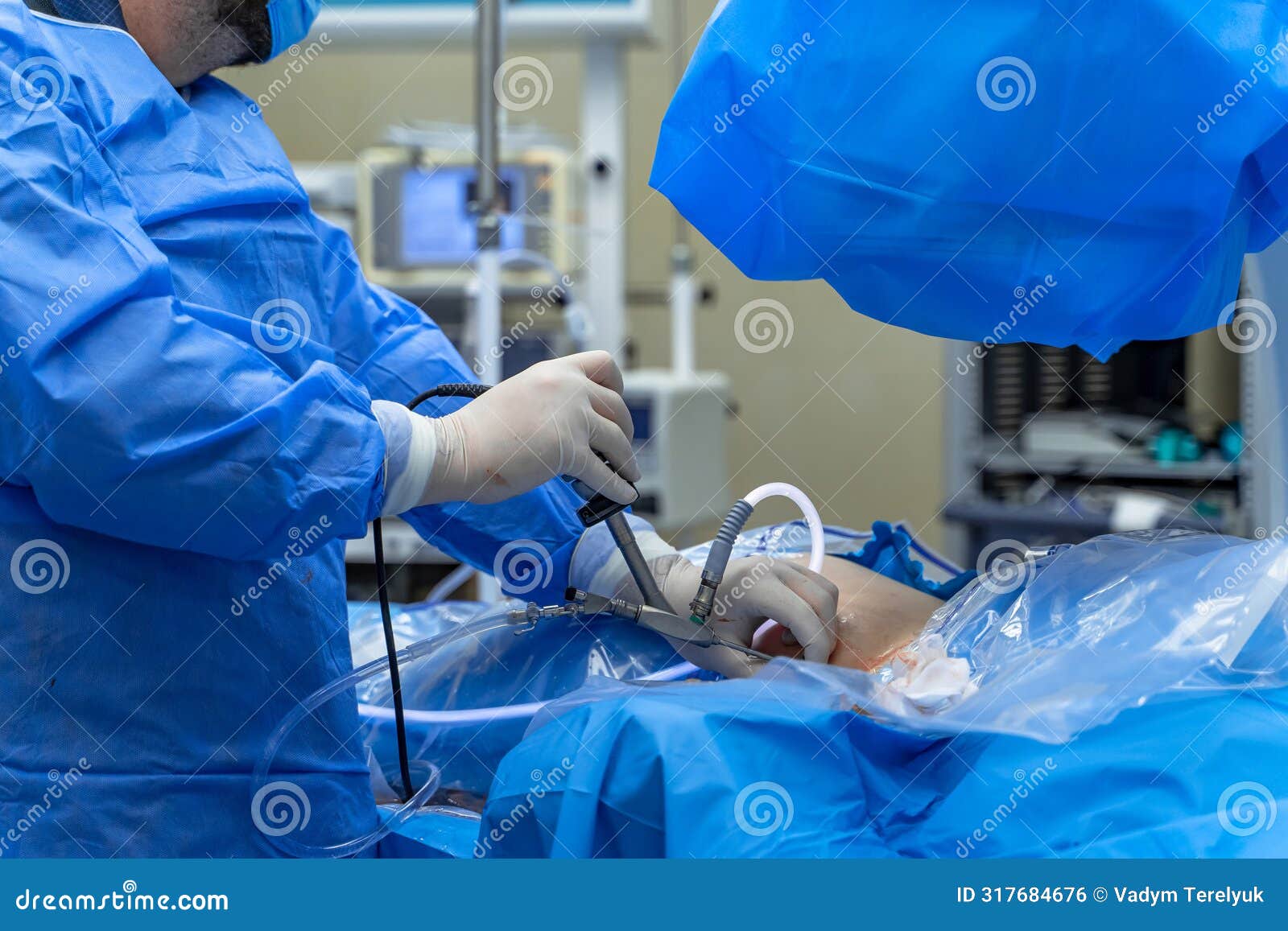 Surgery Modern Operating Equipment. Group of Specialists Performing ...