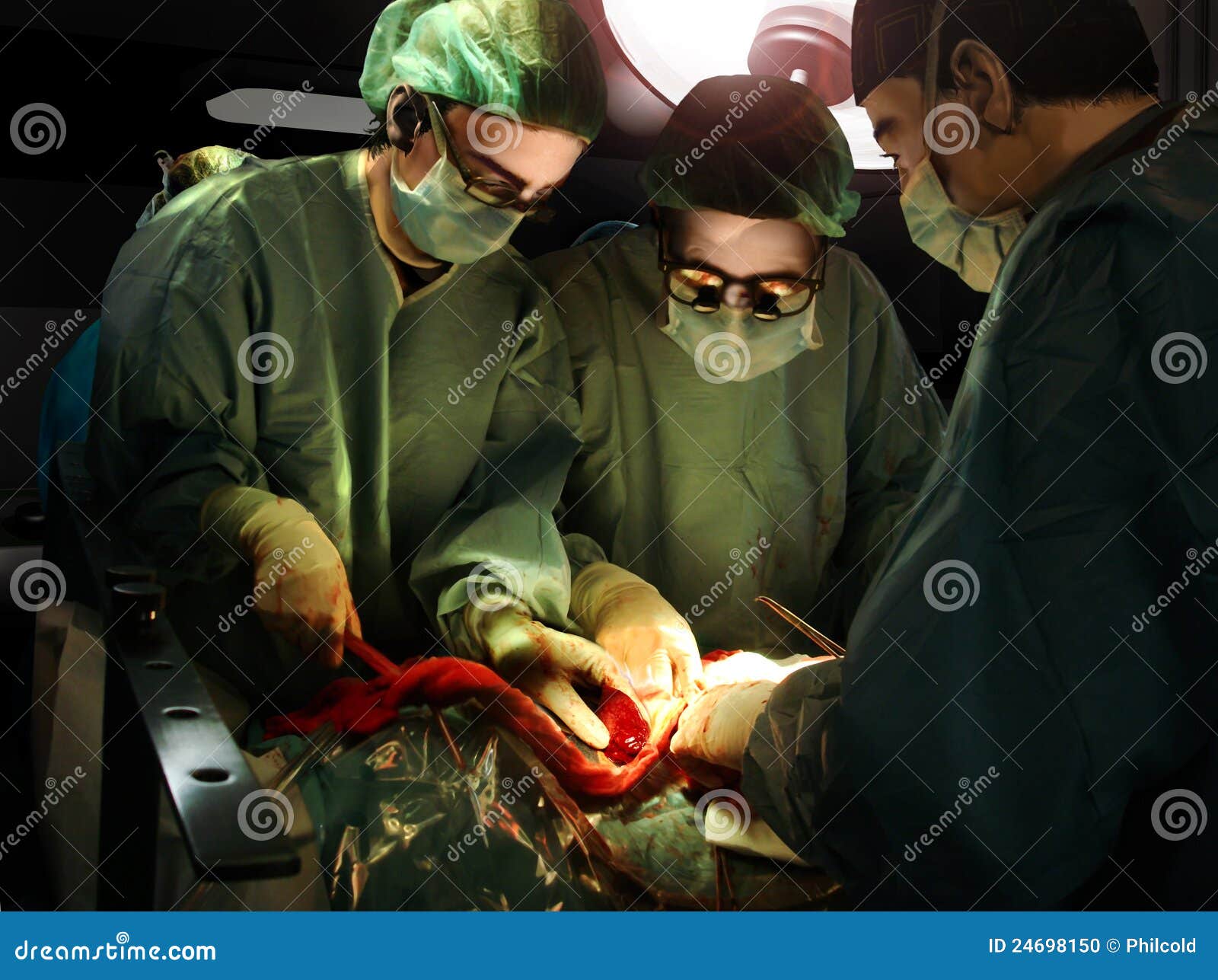 Surgery operation stock illustration. Illustration of doctor - 24698150