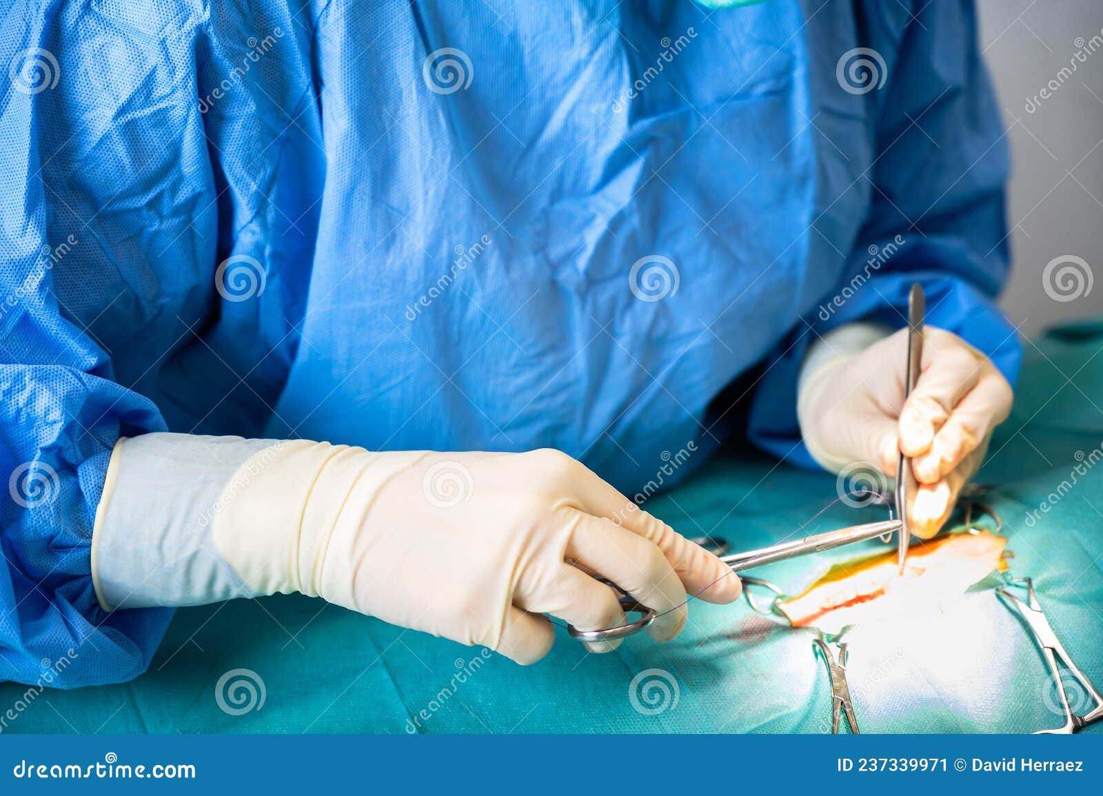 Surgery Operation. Close Up of Surgeon Hands Stitching the Wound after ...