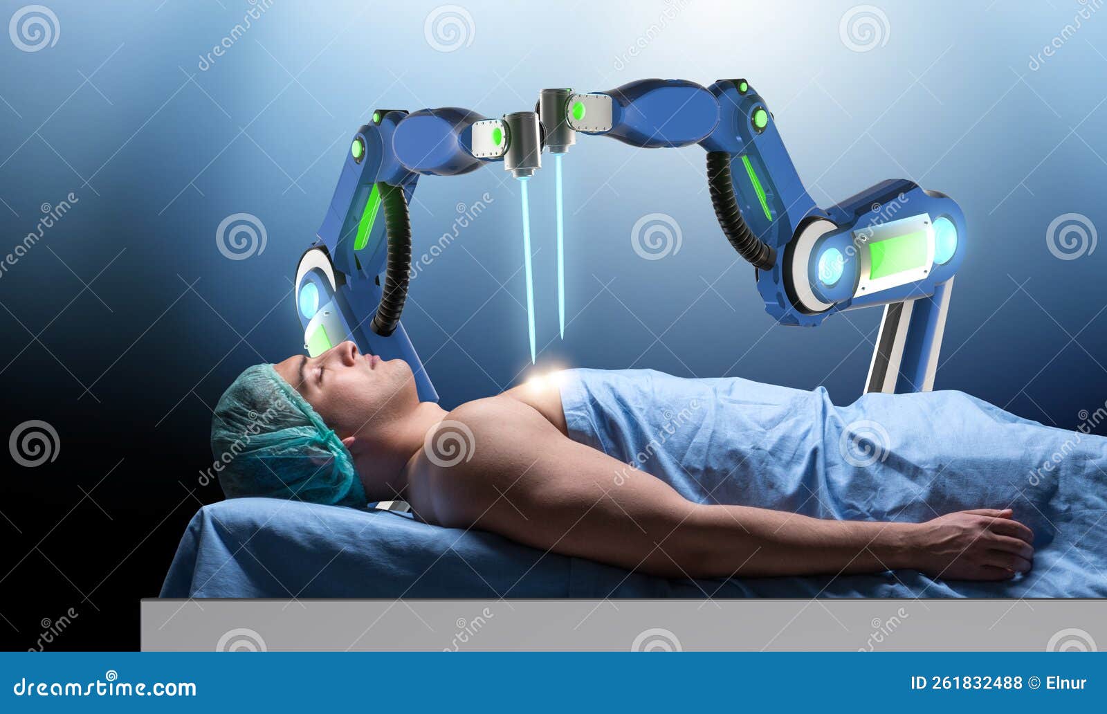 Surgery Performed by Robotic Arm Stock Photo - Image of clinic ... Surgery Performed by Robotic Arm Stock Photo - Image of clinic ...