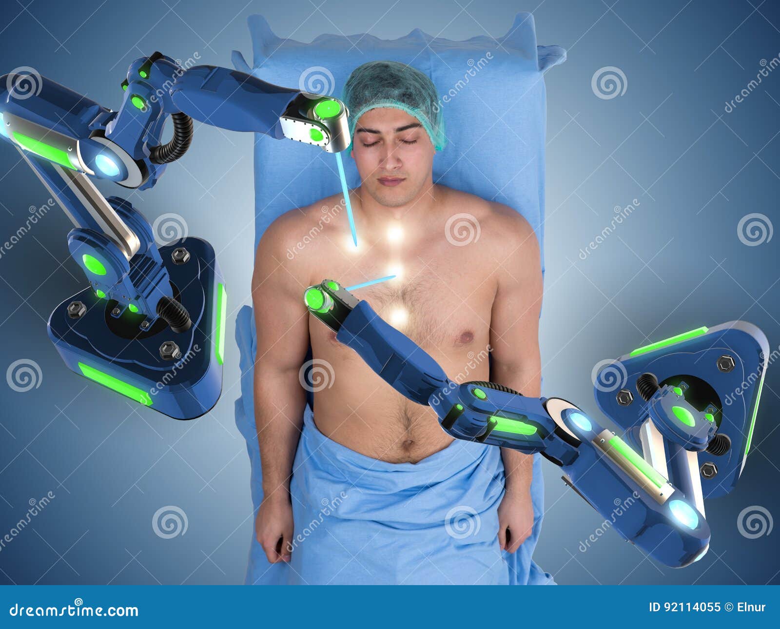 The Surgery Performed by Robotic Arm Stock Image - Image of endoscopy ...