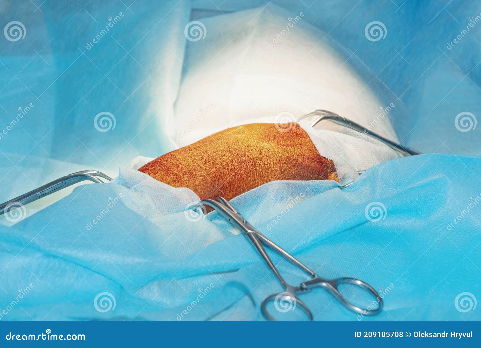 The Surgical Field is Disinfected with Iodine Solution. before Surgery ...