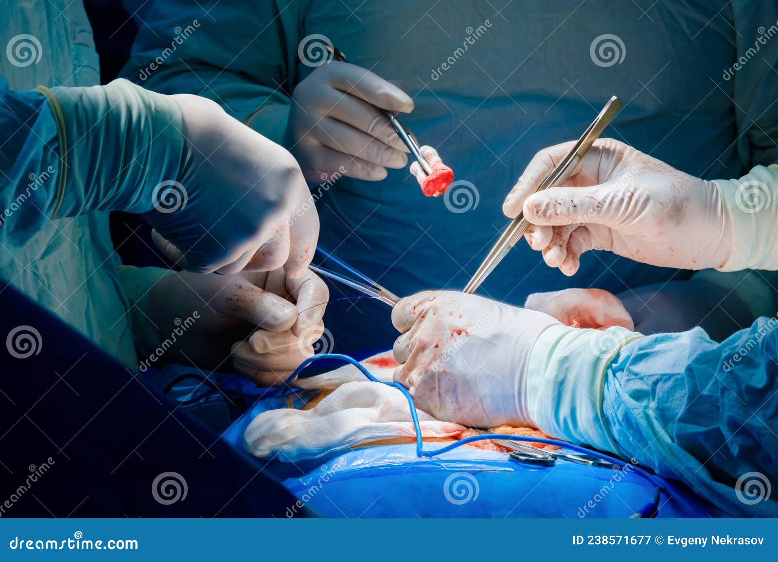 Surgical Instruments in the Hands of Doctors during a Surgical ...