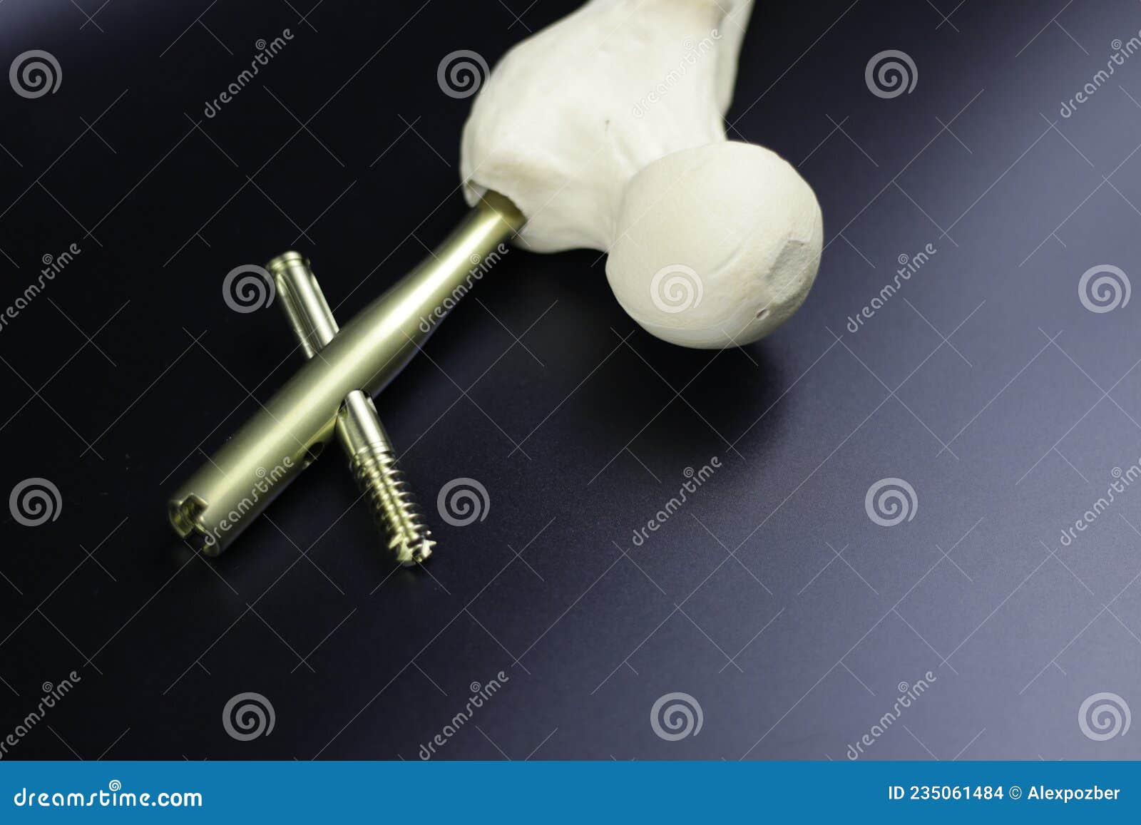 Surgical Instruments in Traumatology for Osteosynthesis of Bone ...