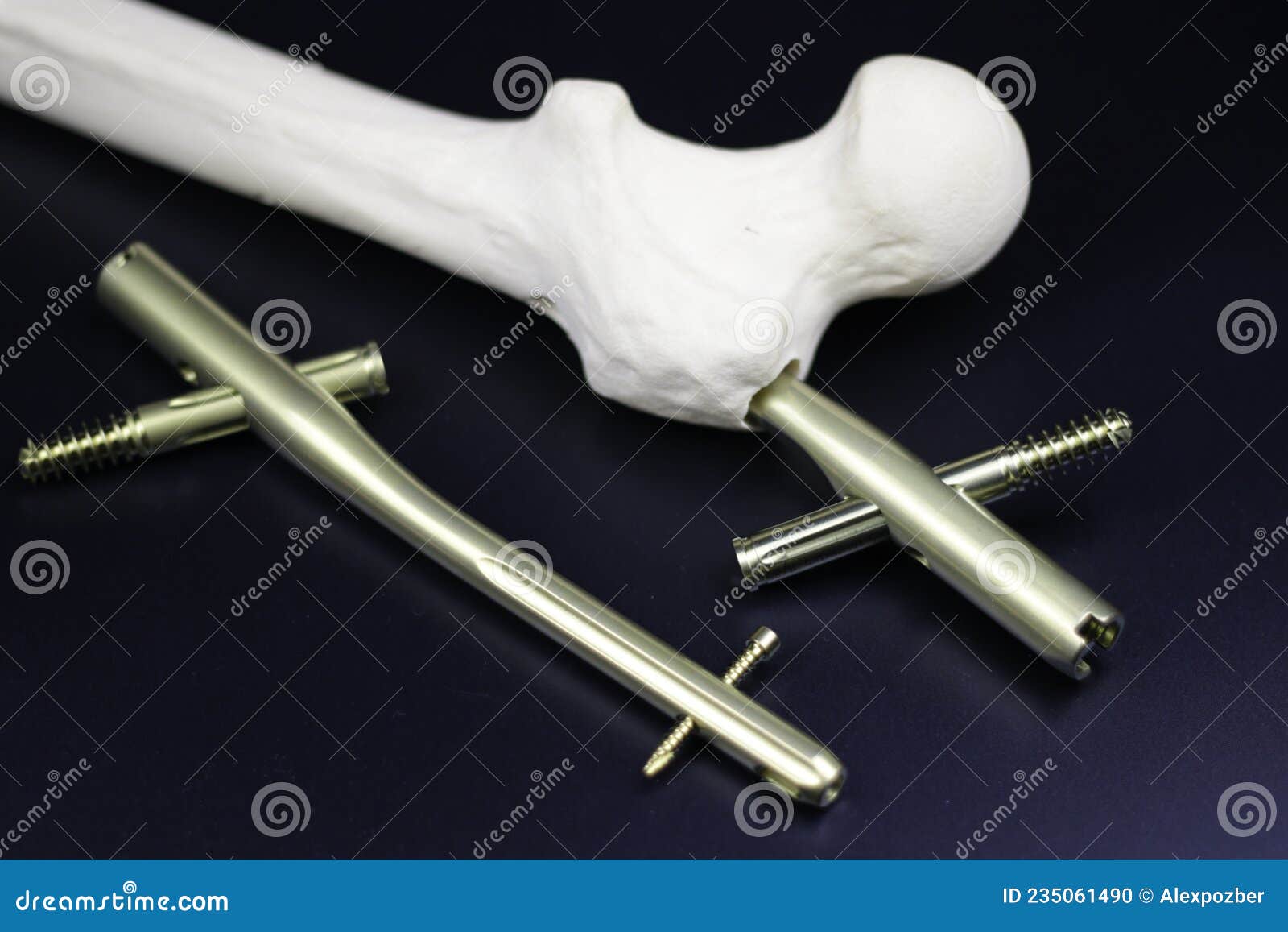 Surgical Instruments in Traumatology for Osteosynthesis of Bone ...