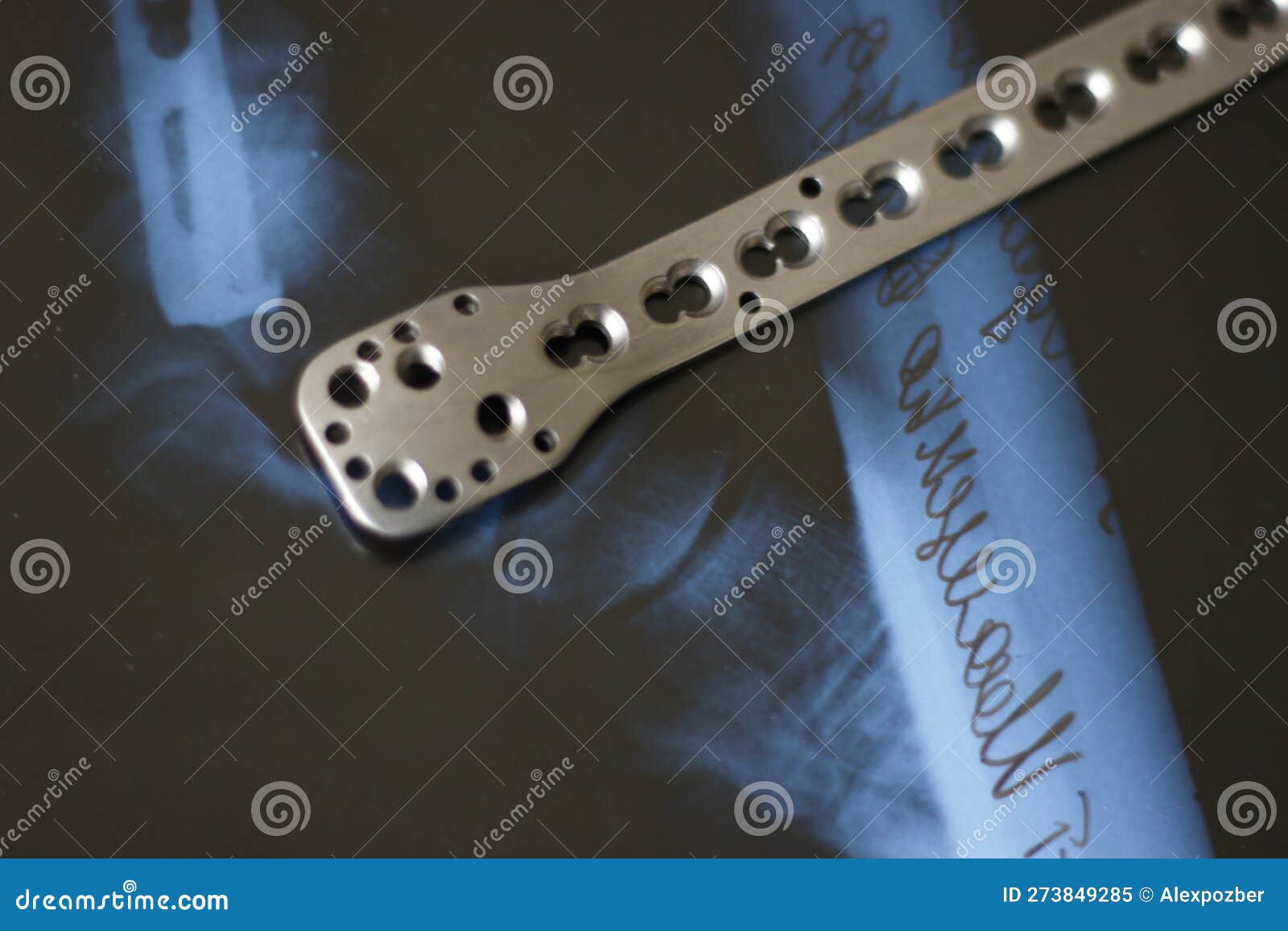 Surgical Instruments in Traumatology for Osteosynthesis of Bone ...