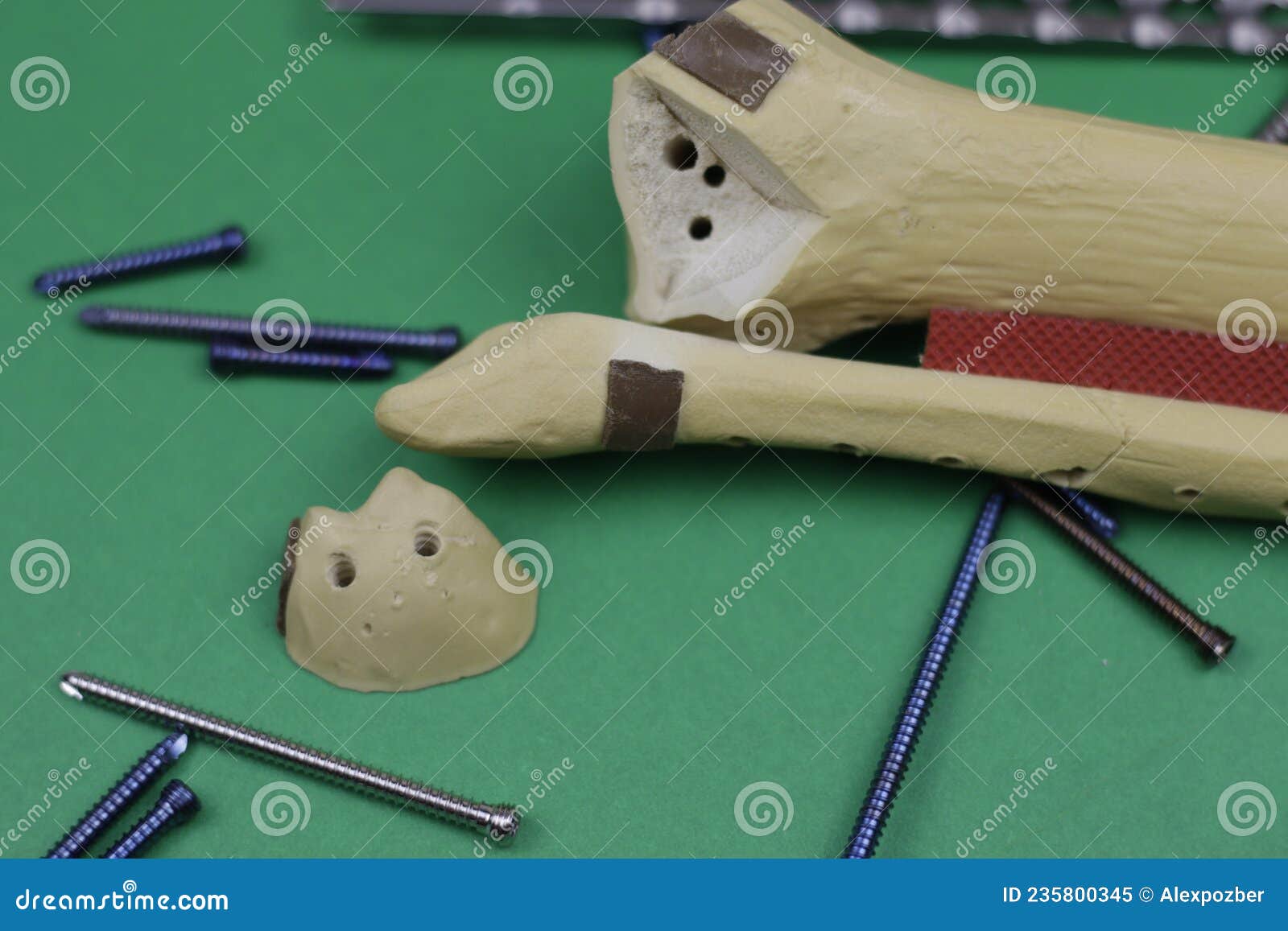 Surgical Instruments in Traumatology for Osteosynthesis of Bone ...