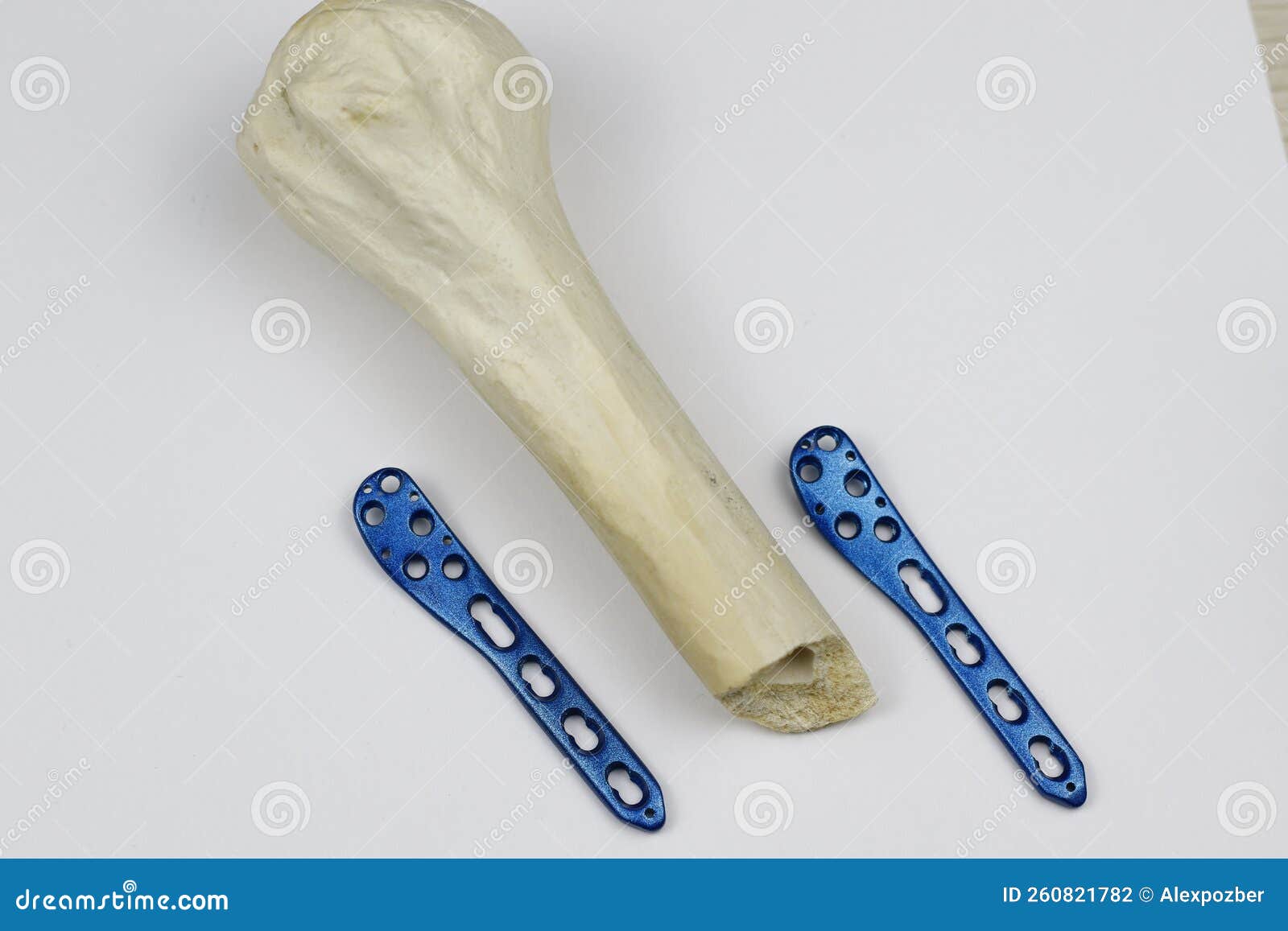 Surgical Instruments in Traumatology for Osteosynthesis of Bone ...