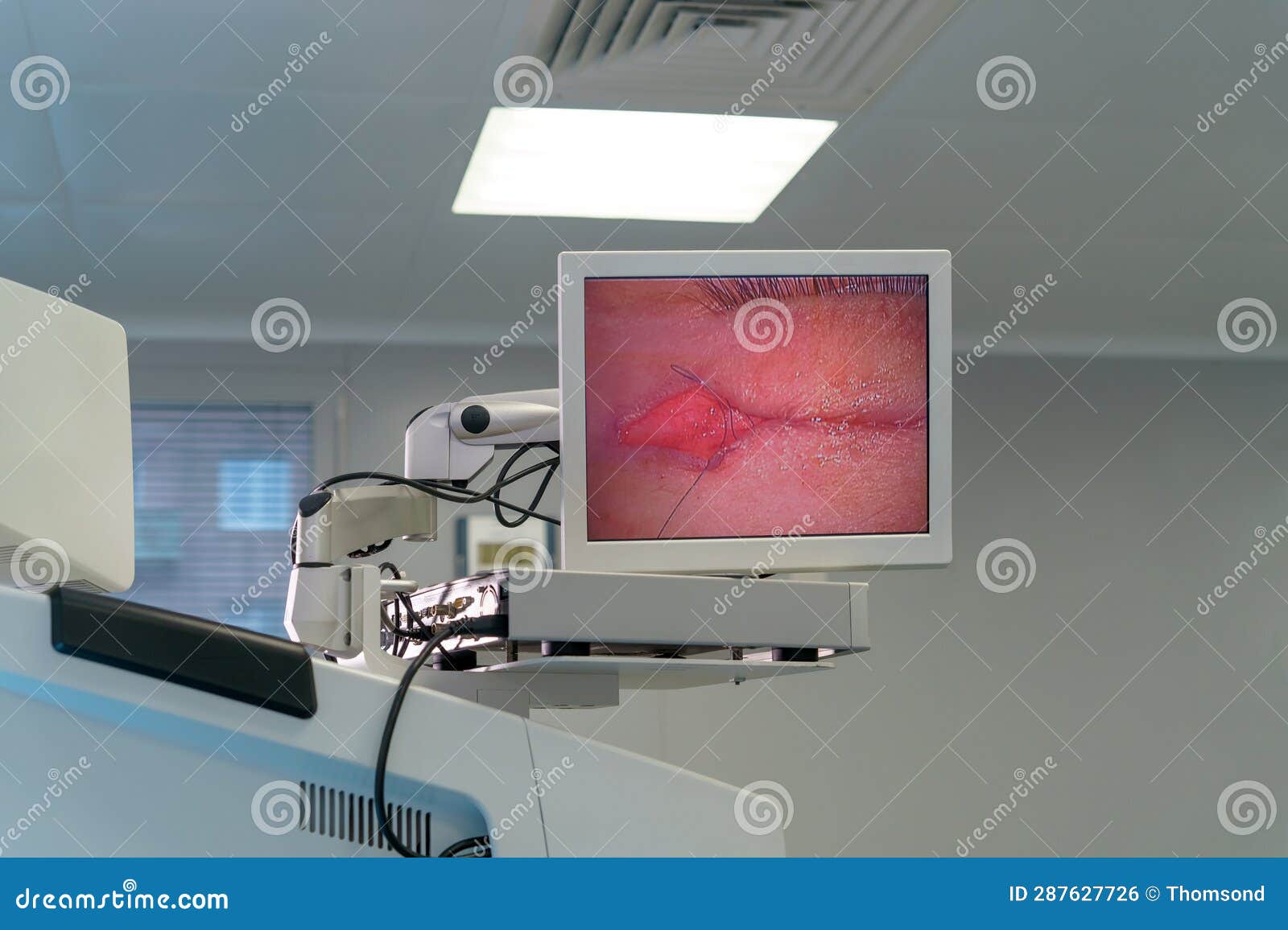 Surgical Microscope in the Operating Room Stock Photo - Image of vision ...