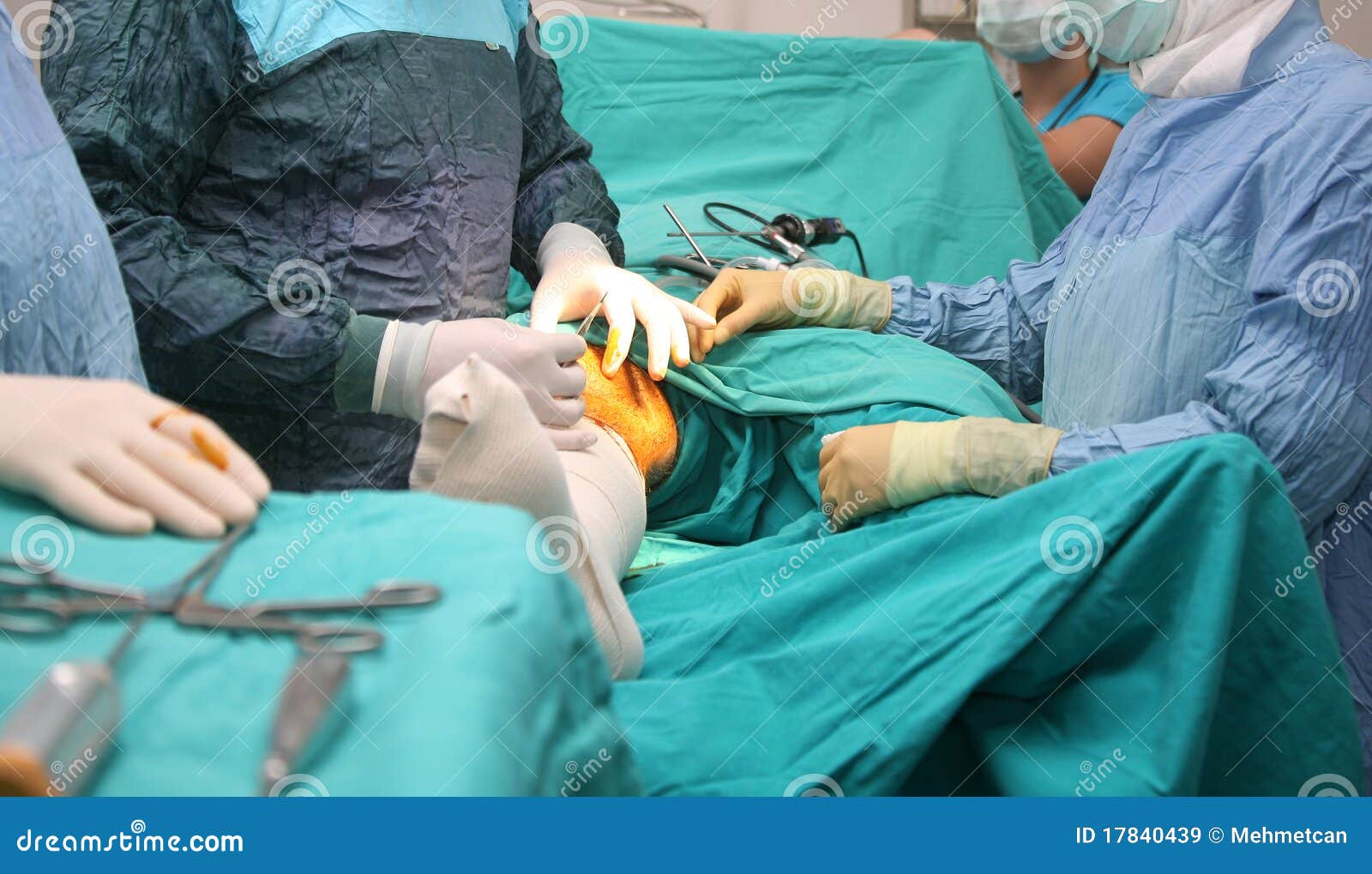 Surgical operation stock image. Image of operating, female - 17840439