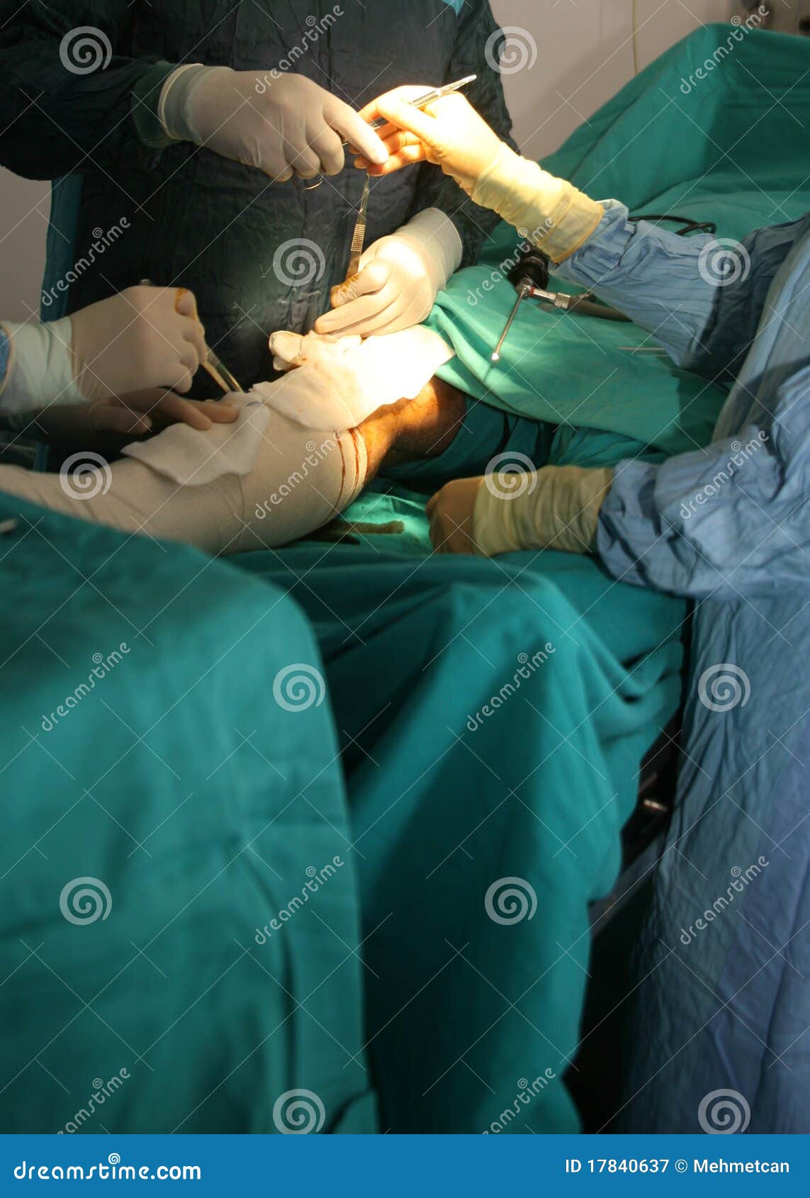 Surgical operation stock image. Image of nurse, caucasian - 17840637