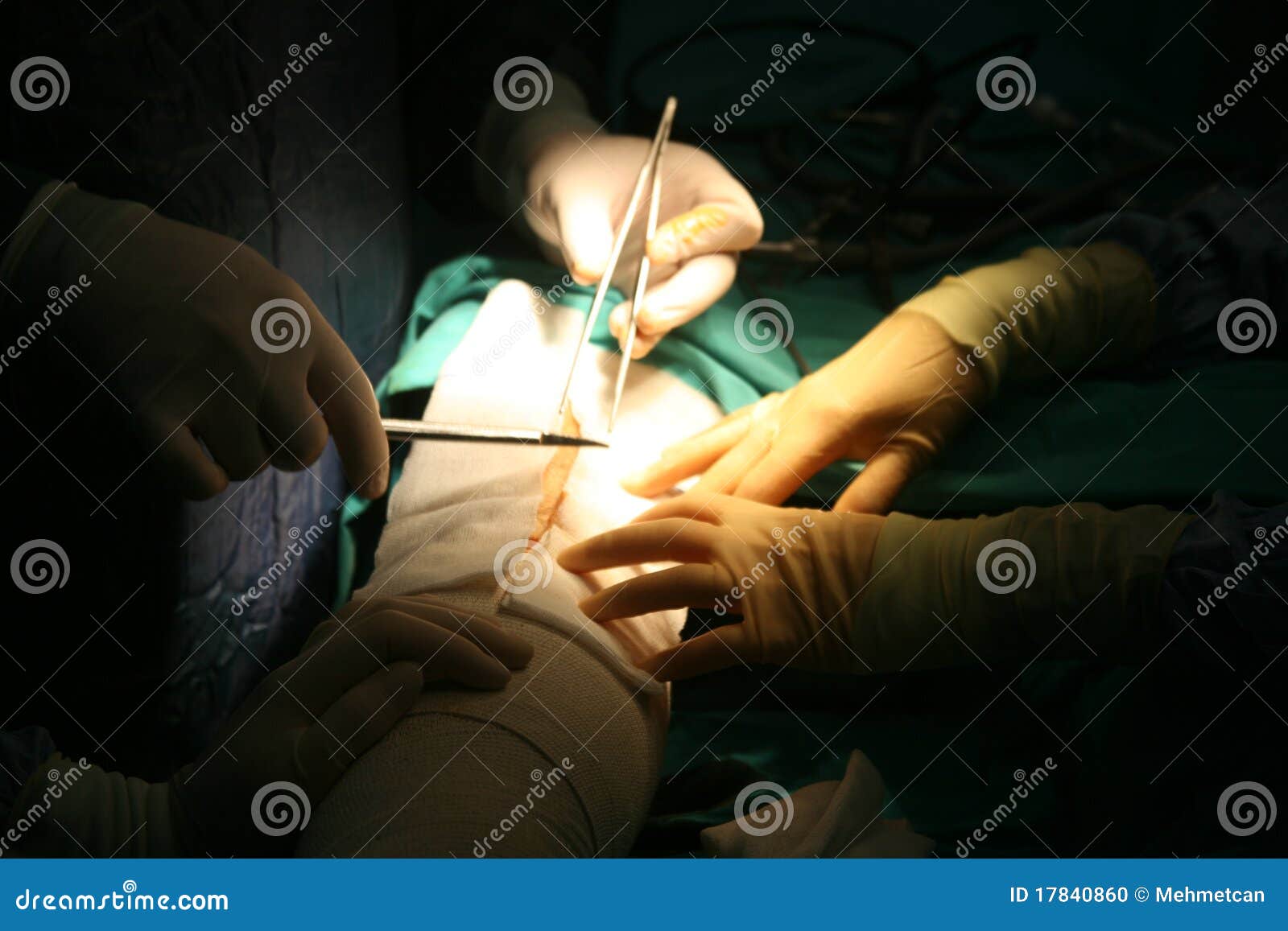 Surgical operation stock photo. Image of operating, medic - 17840860