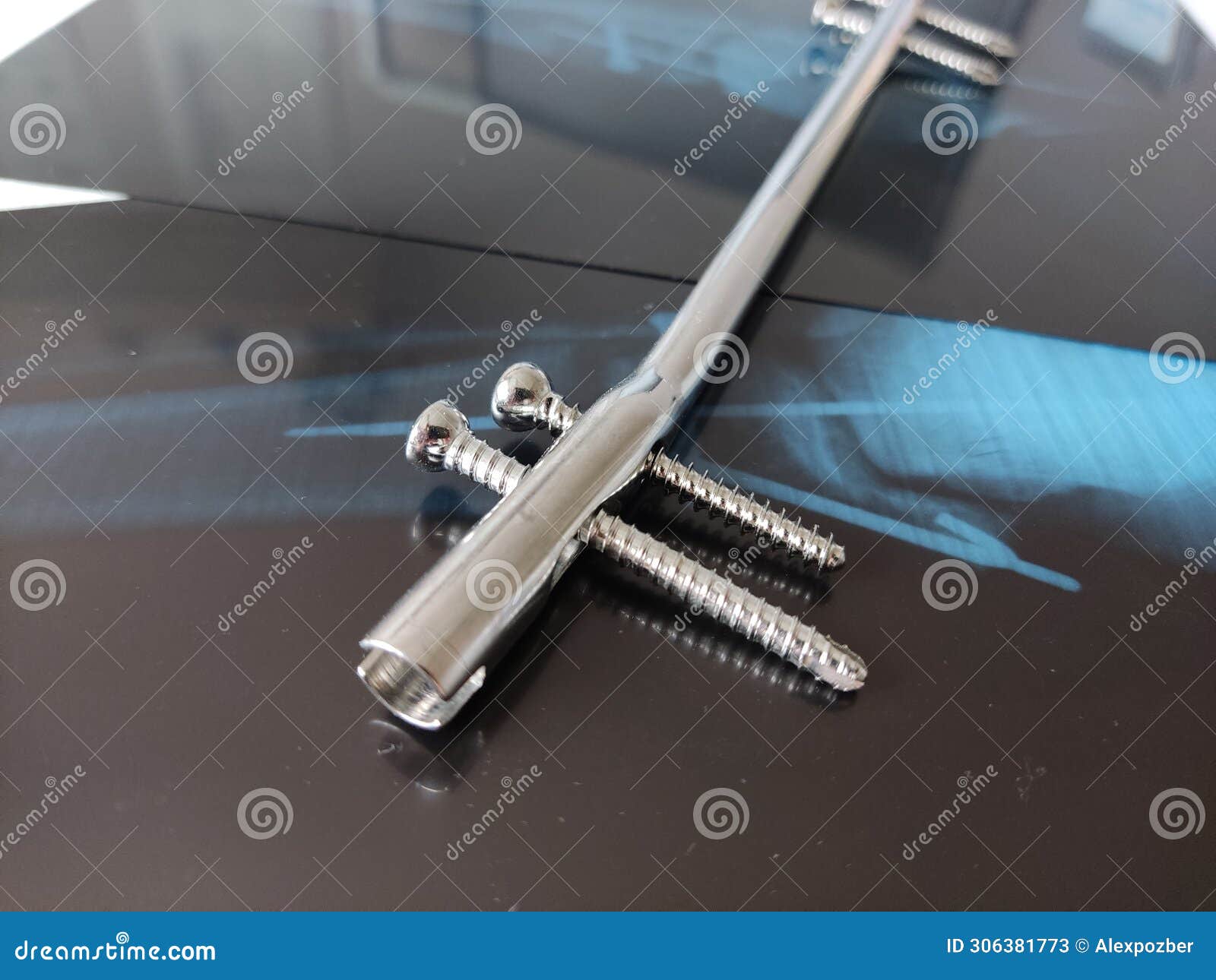 Surgical Plates and Instruments for Osteosynthesis of Bone Fractures ...