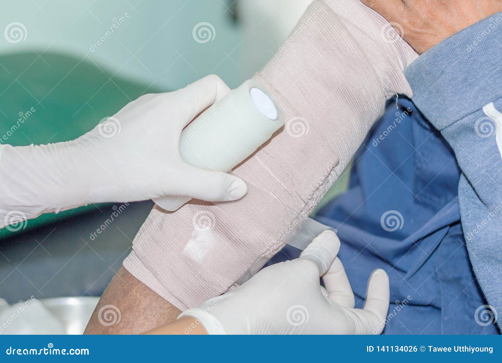 Surgical stapler arm stock photo. Image of treatment - 141134026