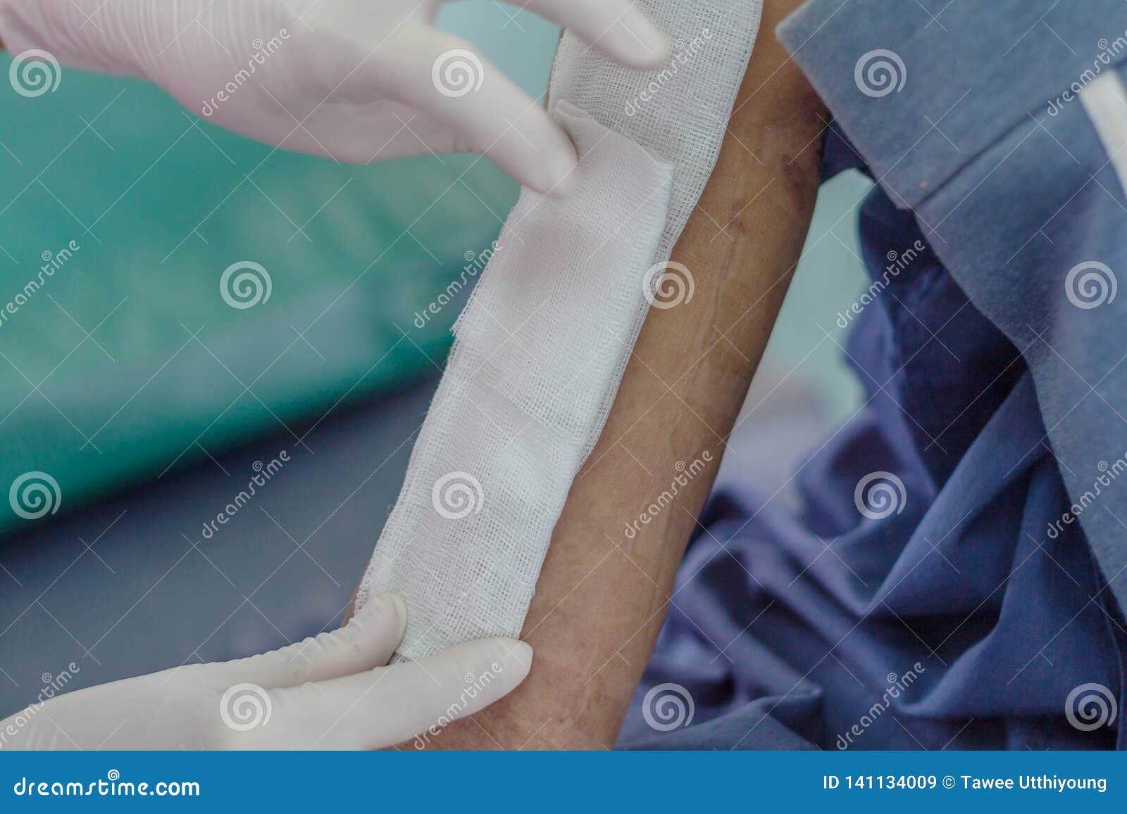 Surgical stapler arm stock image. Image of operation - 141134009