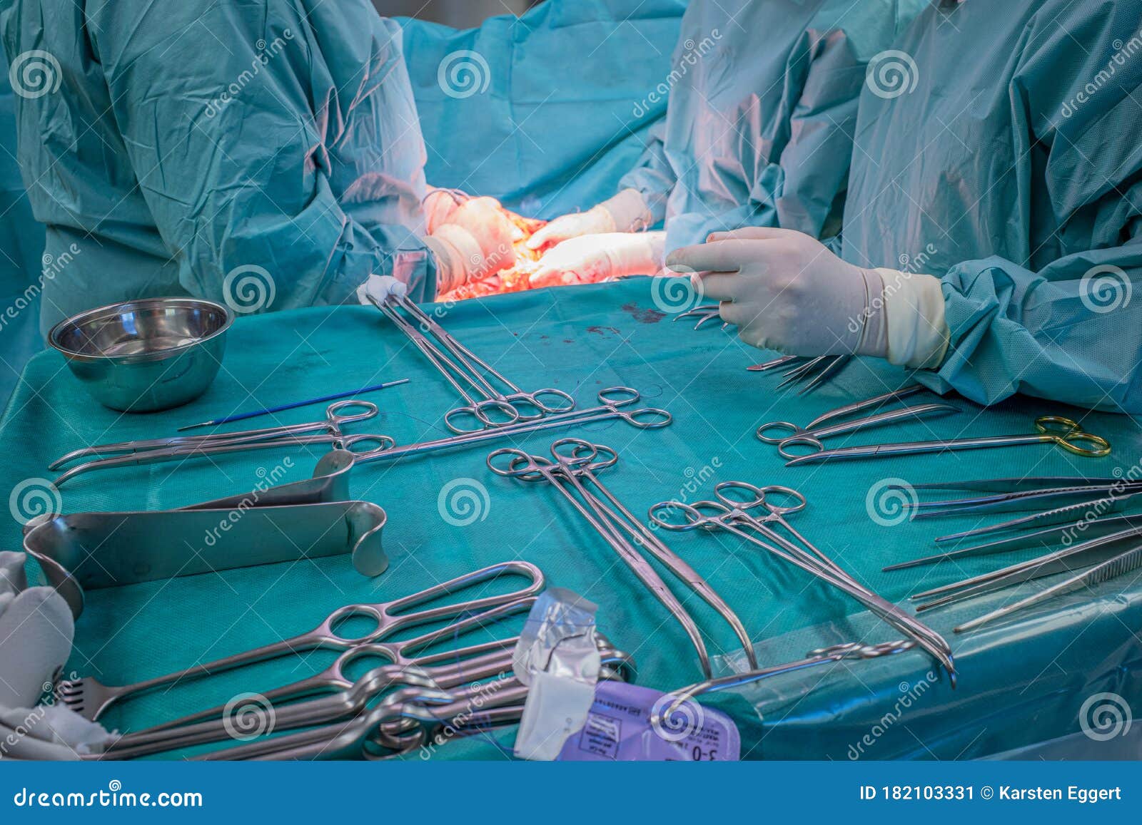 Surgical Team Performs a Surgical Abdominal Operation Stock Image ...