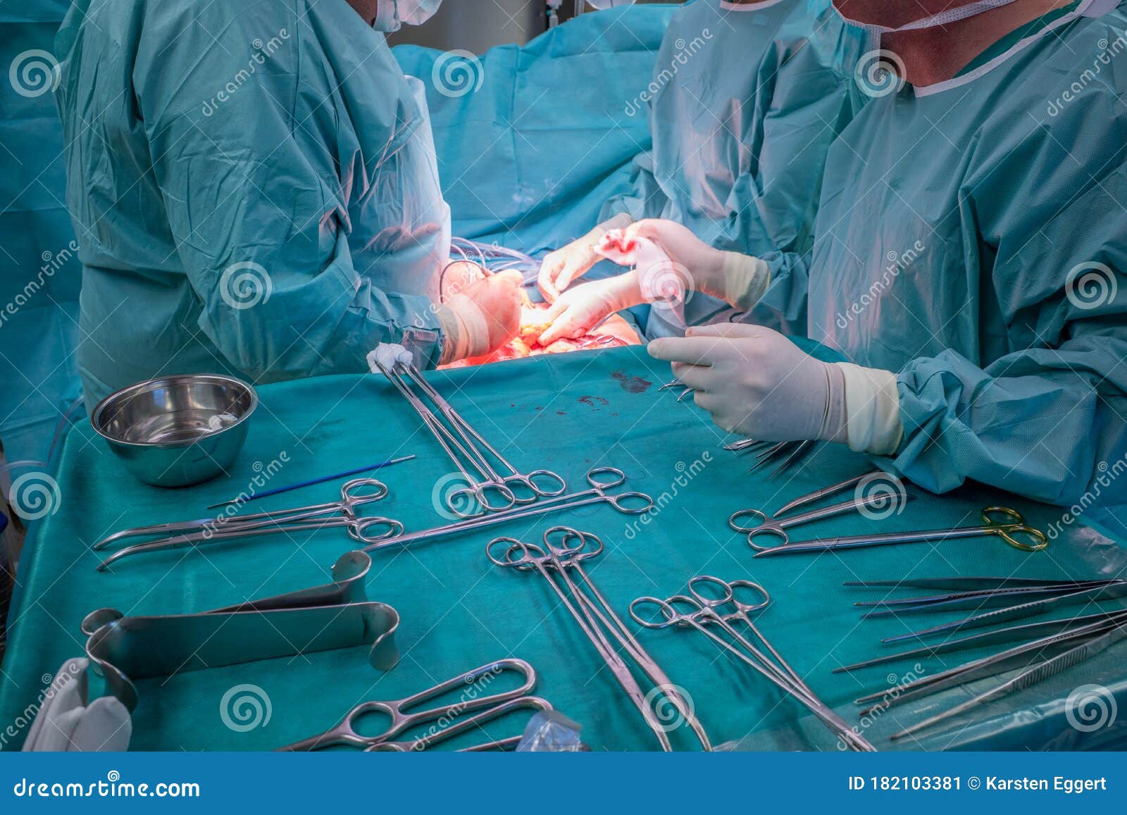 Surgical Team Performs a Surgical Abdominal Operation Stock Image ...