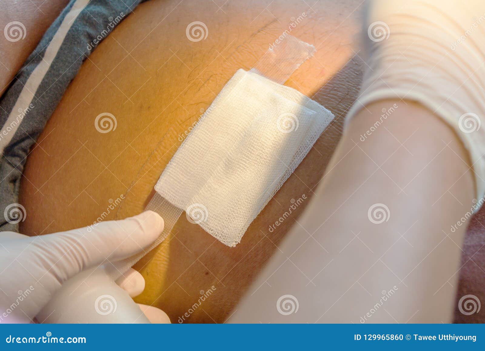 Surgical wound care stock photo. Image of medication - 129965860