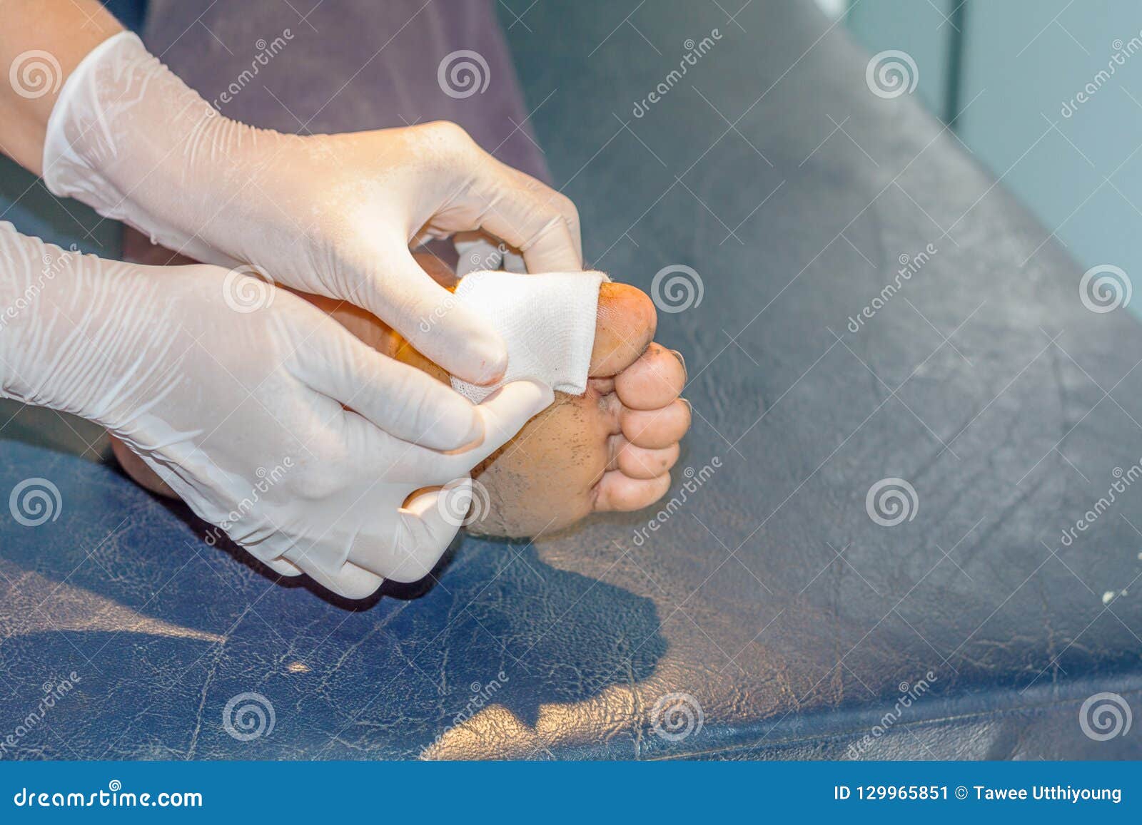 Surgical wound foot stock image. Image of dressing, patient - 129965851