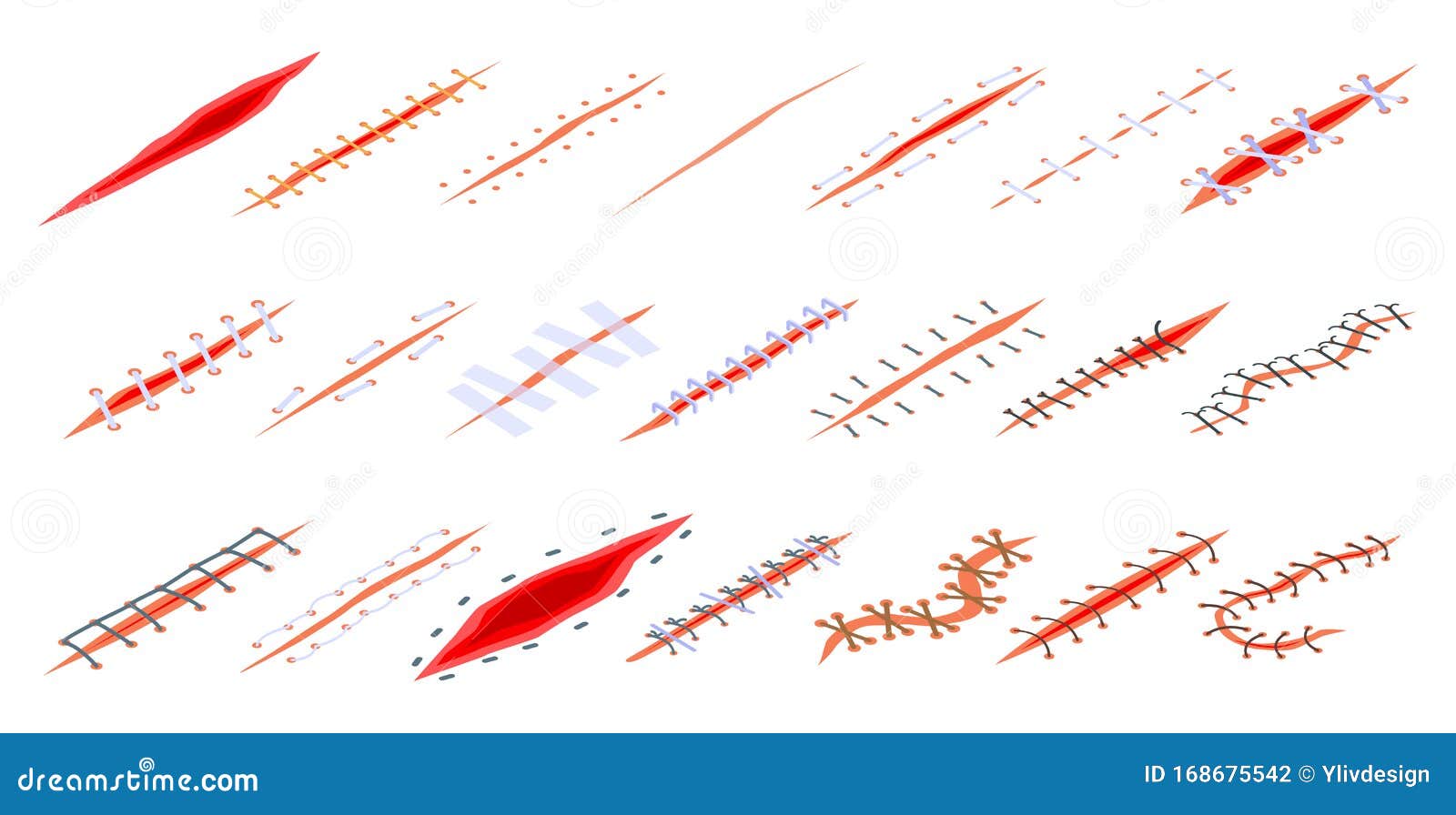 Suture Icons Set, Isometric Style Stock Vector - Illustration of ... Suture Icons Set, Isometric Style Stock Vector - Illustration of ...