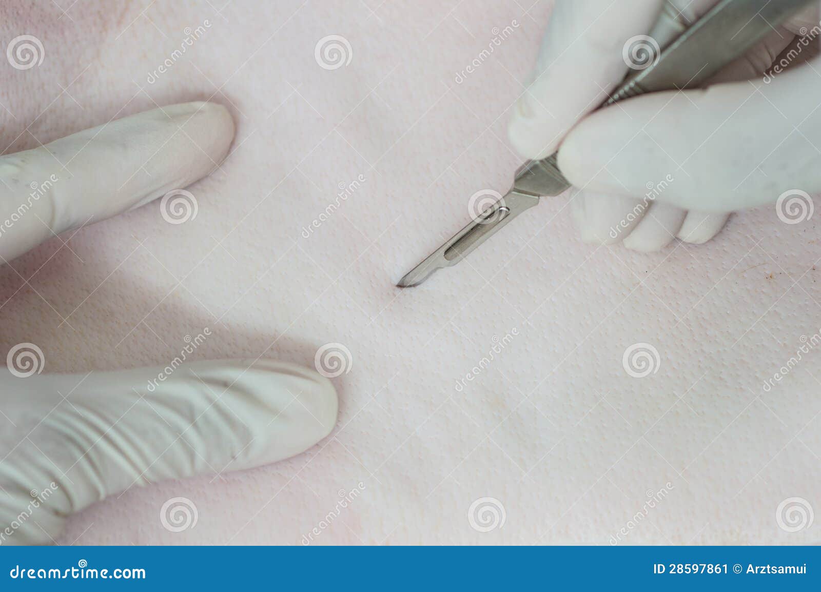 Suture skin stock image. Image of health, services, stainless - 28597861