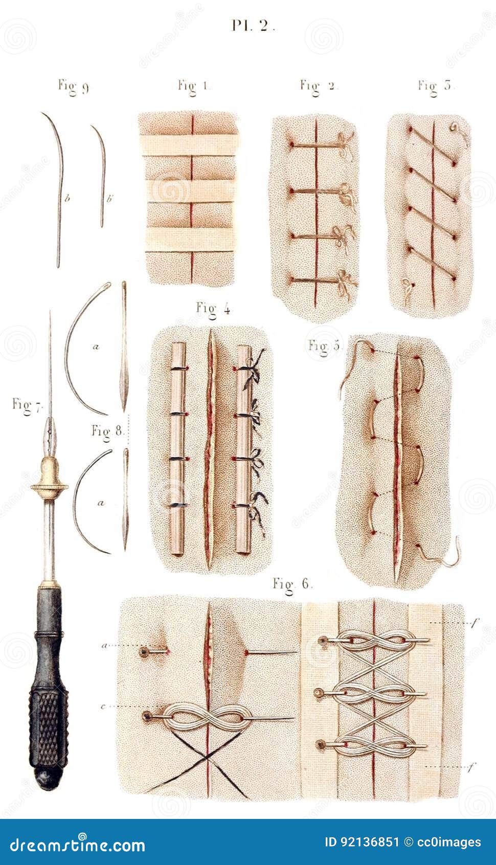 Sutures Picture. Image: 92136851