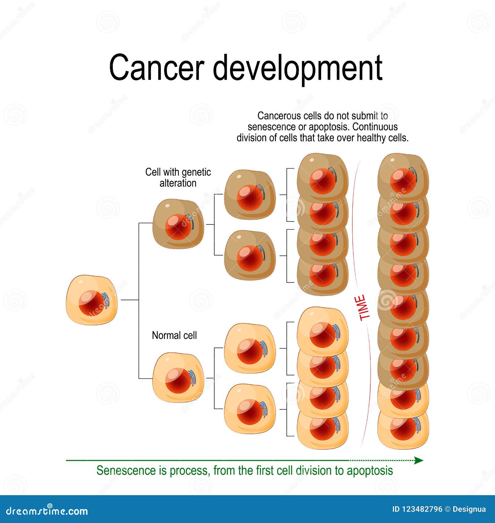 Sviluppo del Cancro illustrazione vettoriale. Illustrazione di schema ...