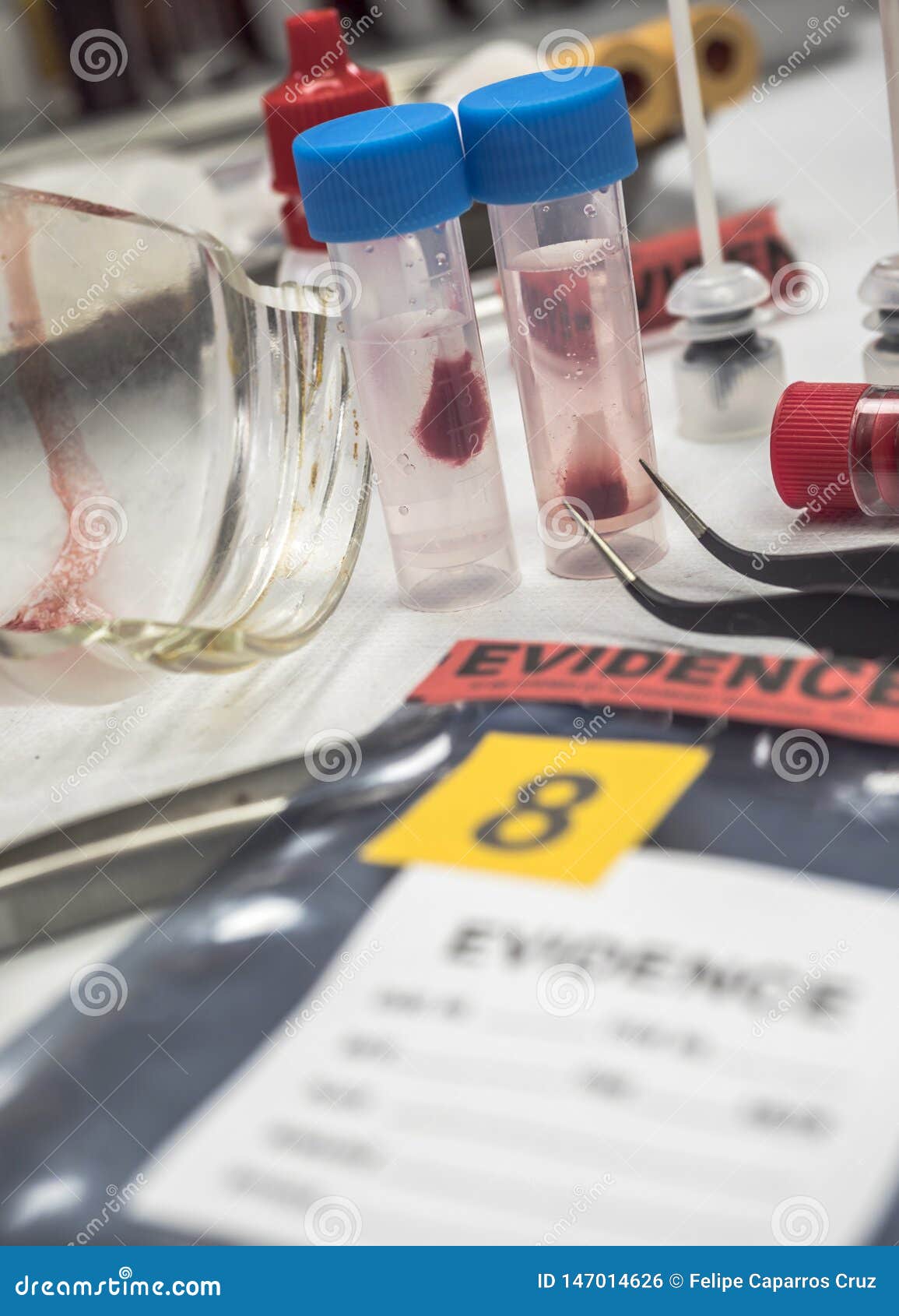 Swabs with Blood Sample To Be Analyzed in the Laboratory Stock Photo ...