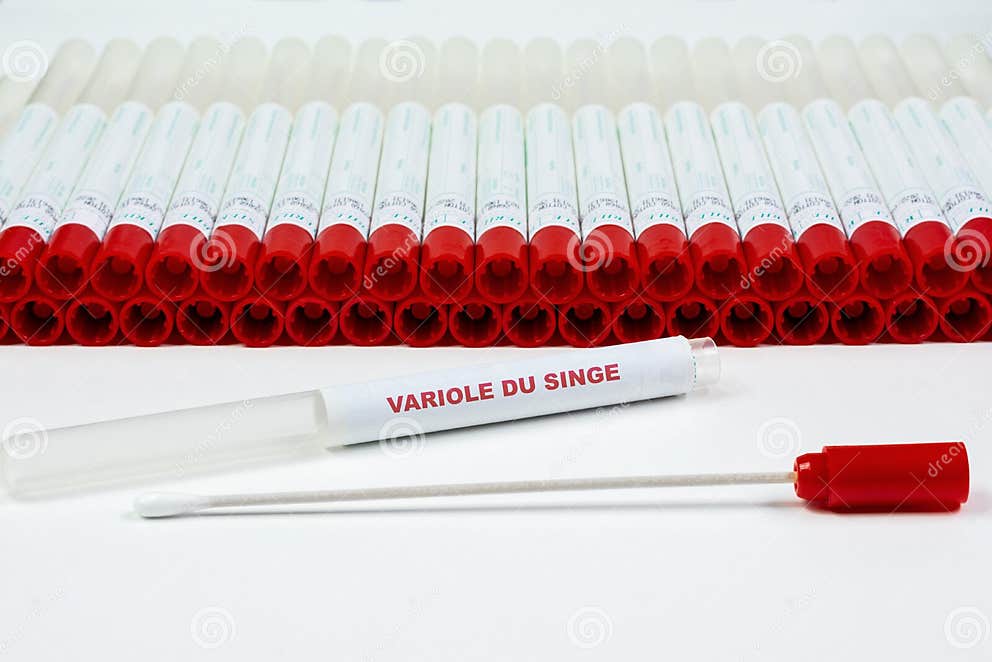 PCR Test for Monkeypox Screening Stock Photo - Image of screening ...