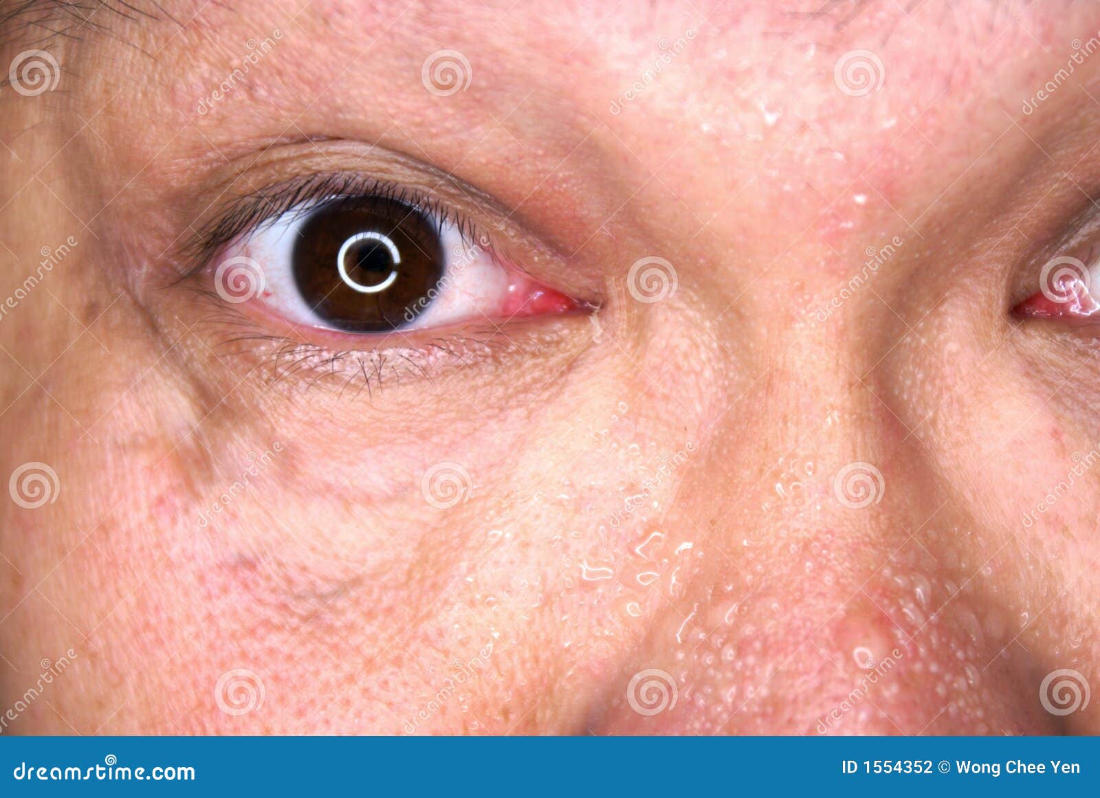 Sweaty face and eye stock photo. Image of expression, distress - 1554352