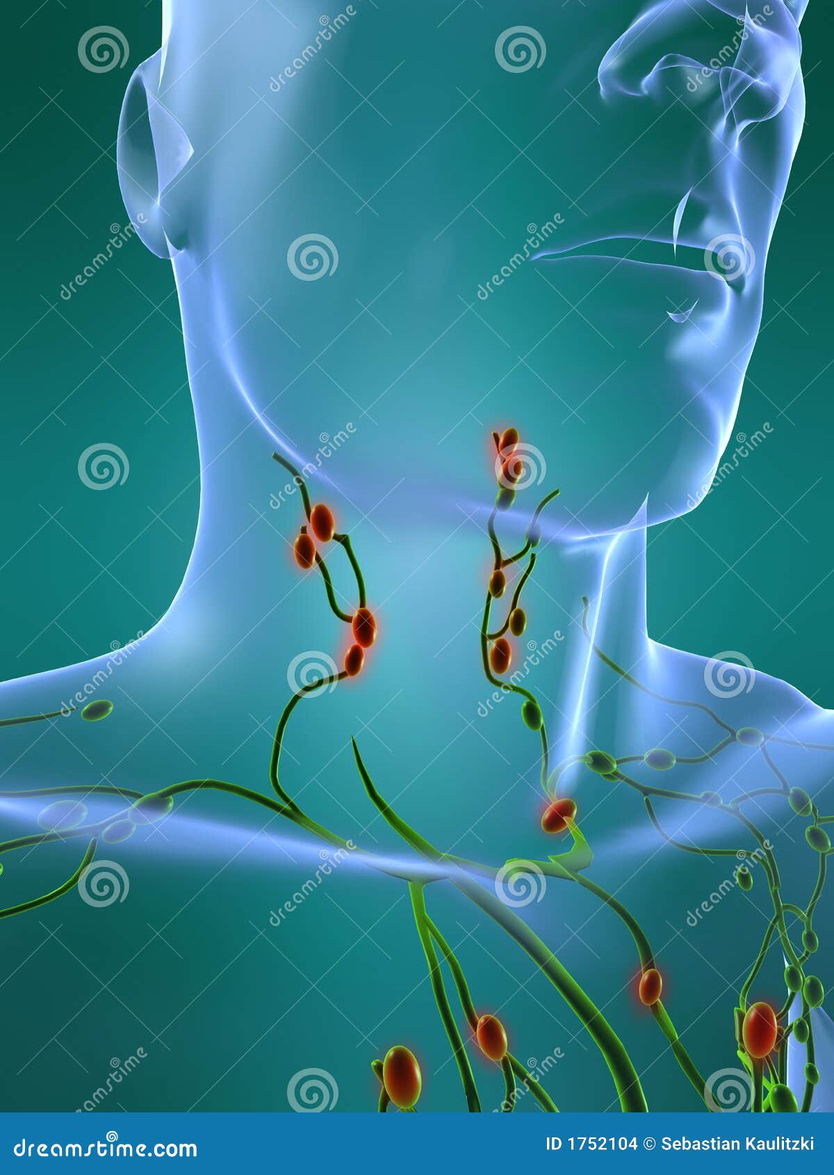 Swollen Lymph Nodes RGB Color Icon Cartoon Vector | CartoonDealer.com ... Swollen Lymph Nodes RGB Color Icon Cartoon Vector | CartoonDealer.com ...