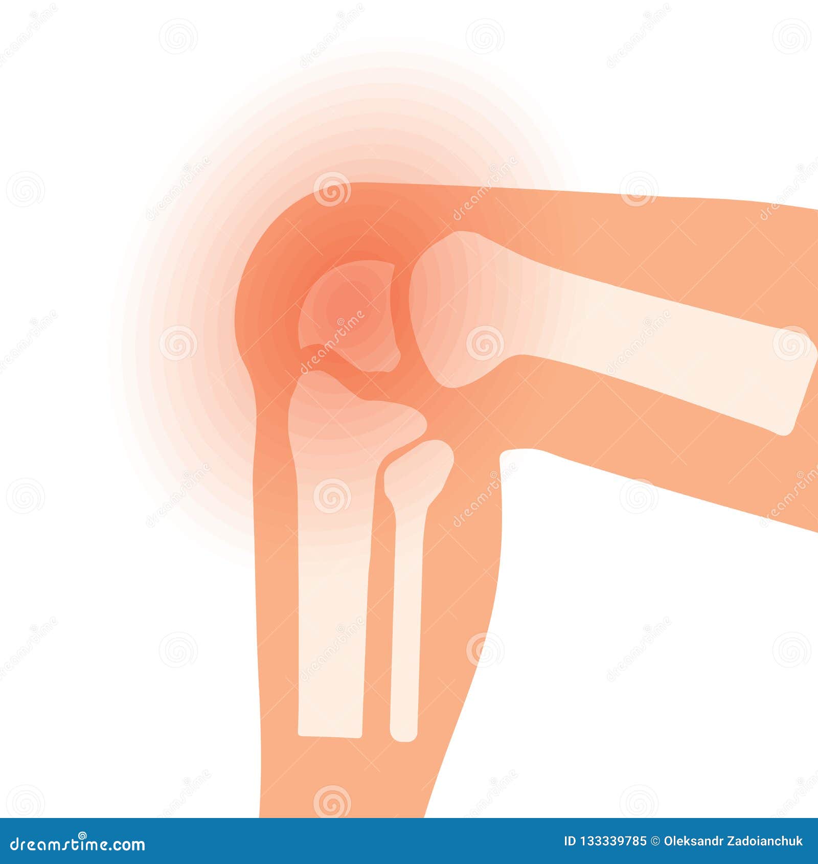Symbol Of Knee Joint Bones Cartoon Vector | CartoonDealer.com #133339913