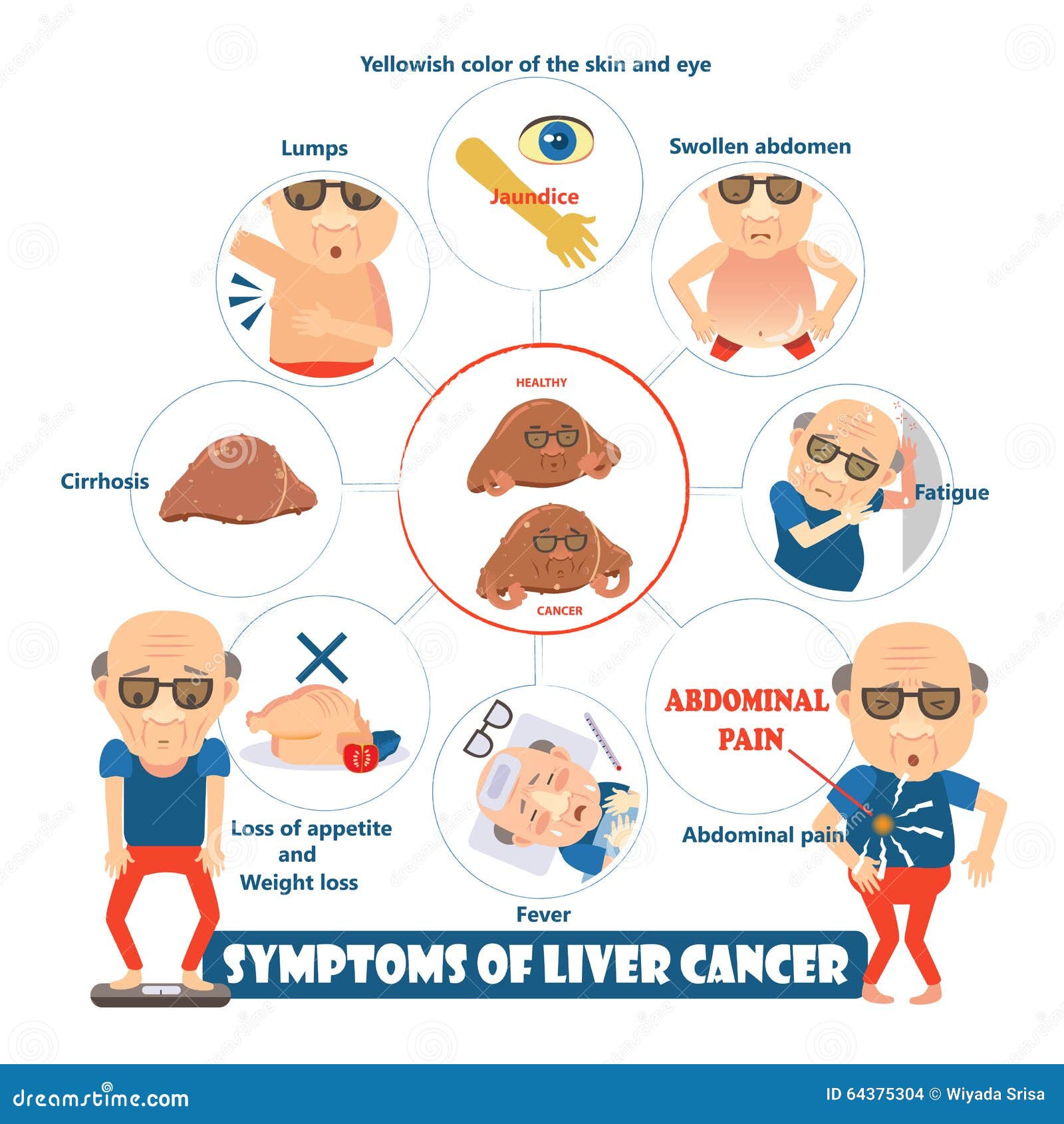 Symptômes De Cancer De Foie Illustration de Vecteur - Illustration du ...