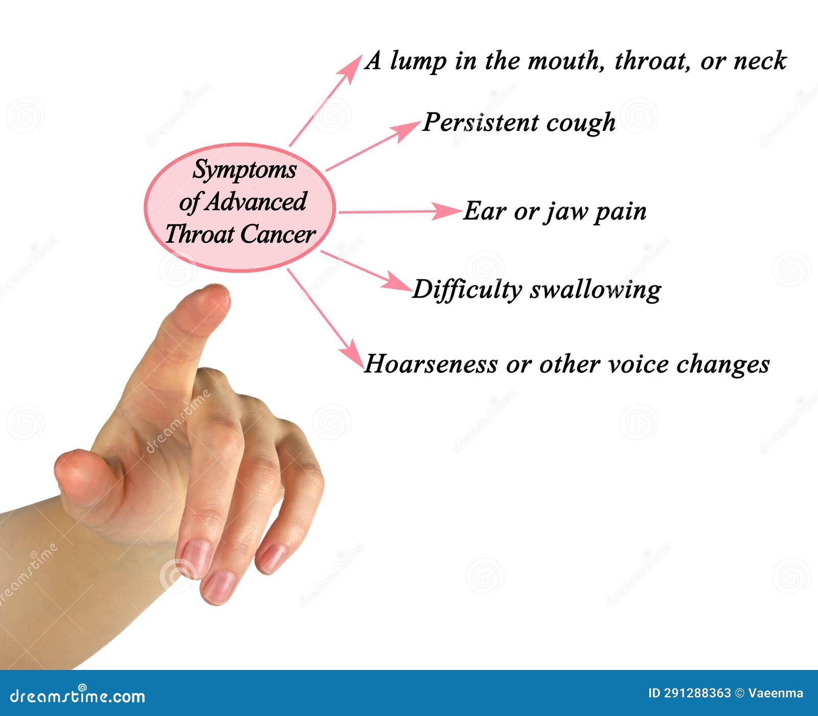 Symptoms of Advanced Throat Cancer Stock Image - Image of lump, pain ...
