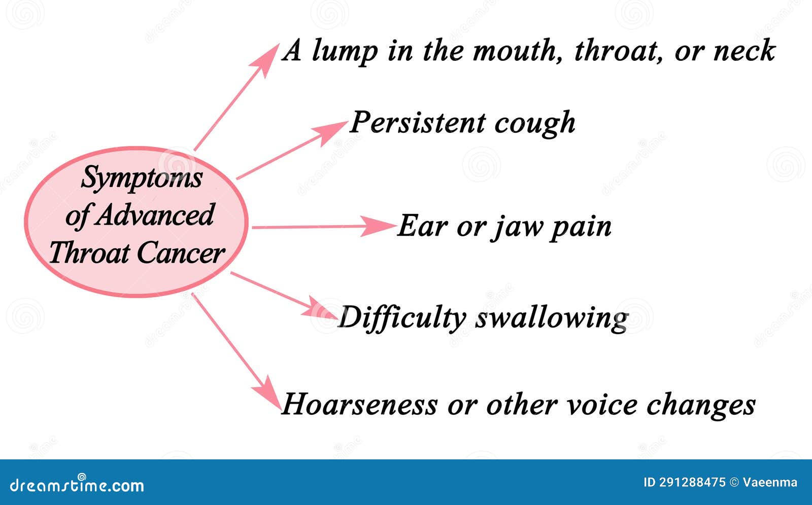 Symptoms of Advanced Throat Cancer Stock Image - Image of hoarseness ...