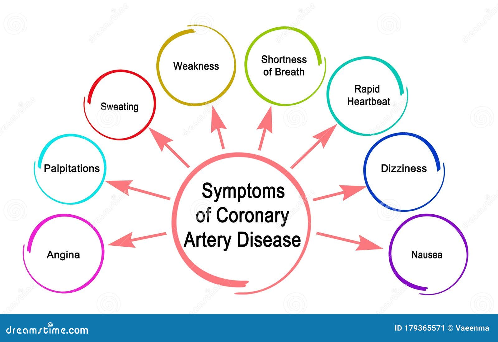 Symptoms of Coronary Artery Disease Stock Illustration - Illustration ...