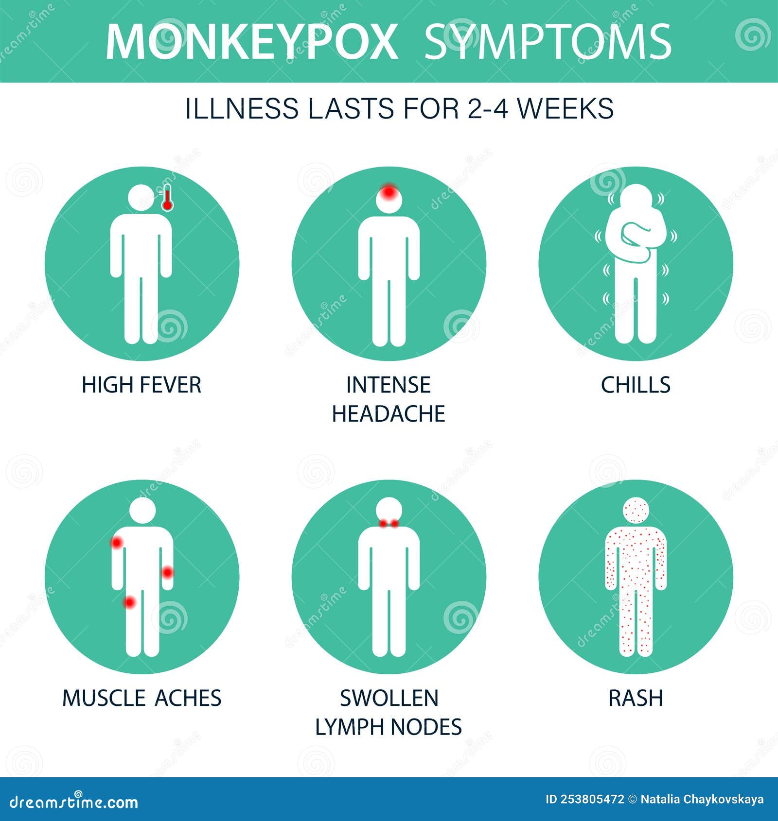 Symptoms of the Monkeypox Virus. Symptoms of the Monkeypox Virus. Stock ...